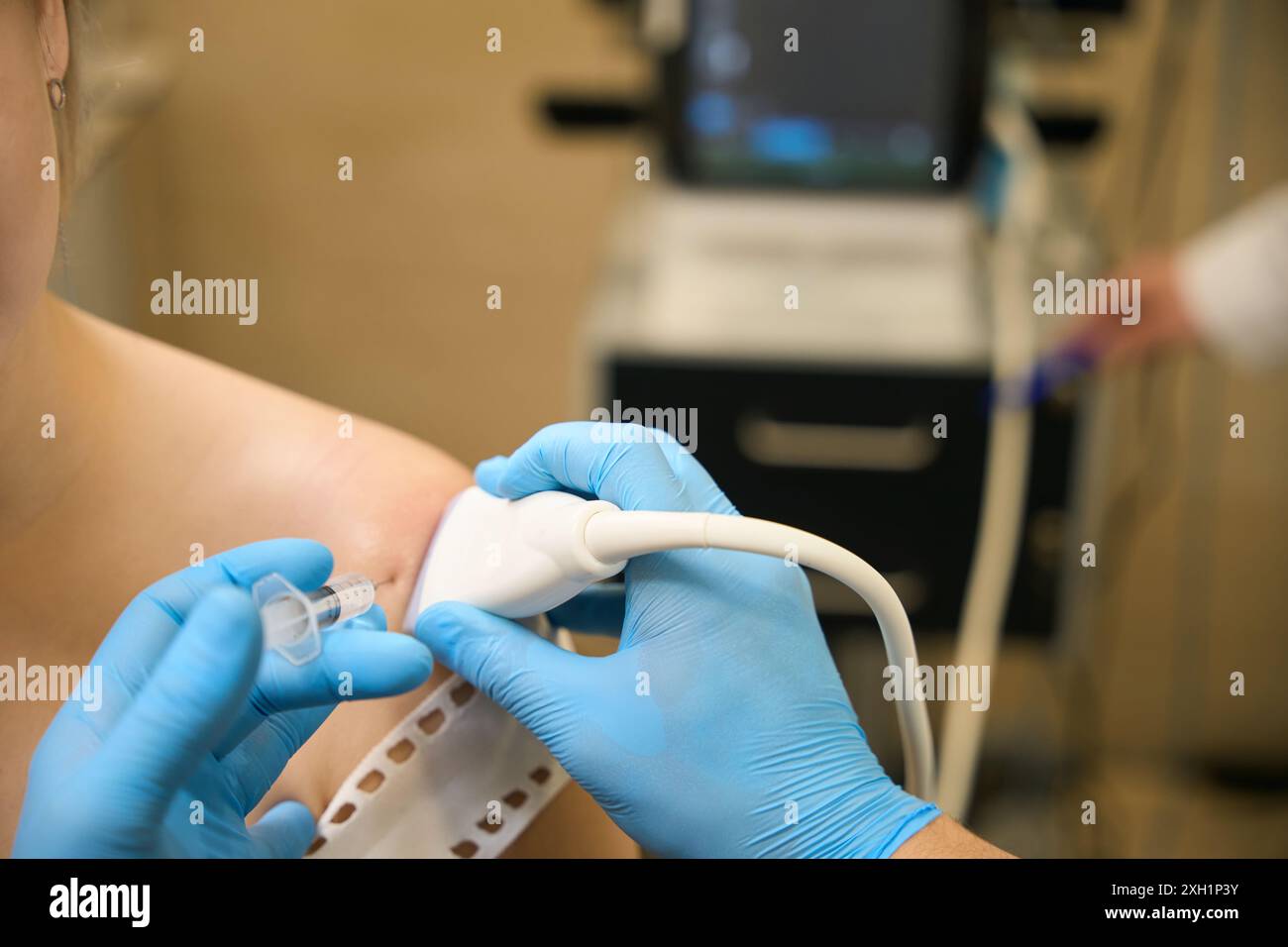 Glenohumeral joint hi-res stock photography and images - Alamy