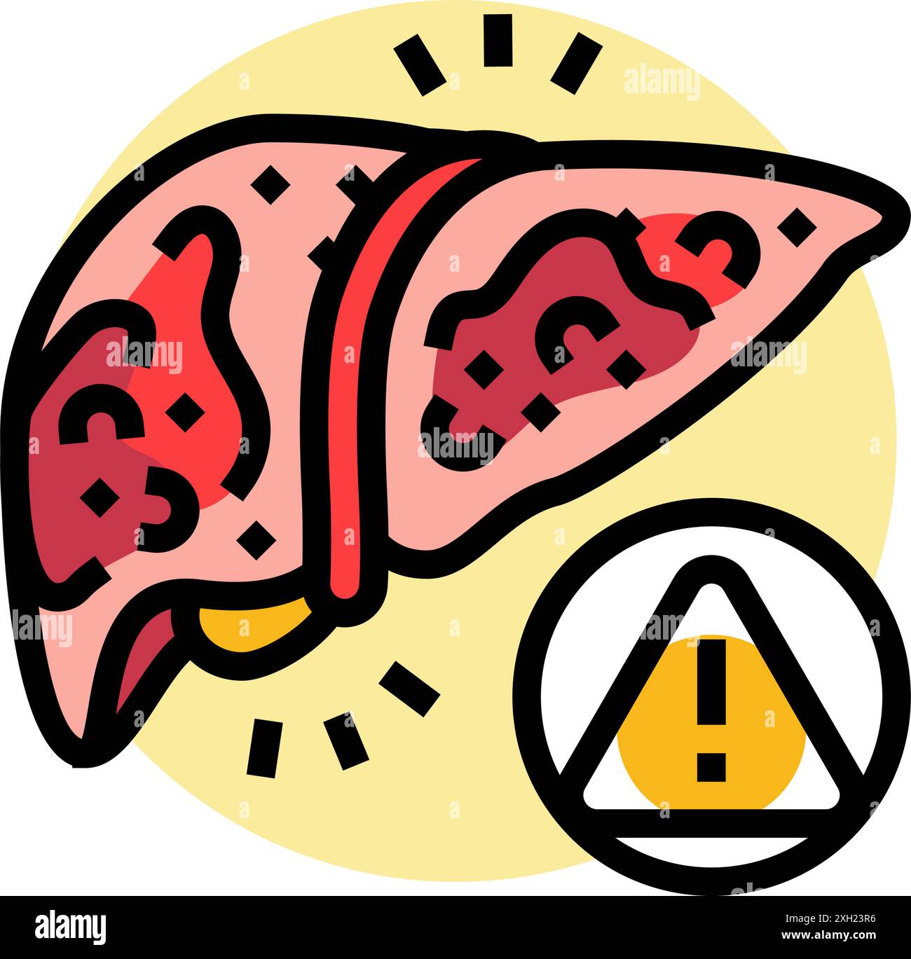 fatty liver disease obesity overweight color icon vector illustration ...