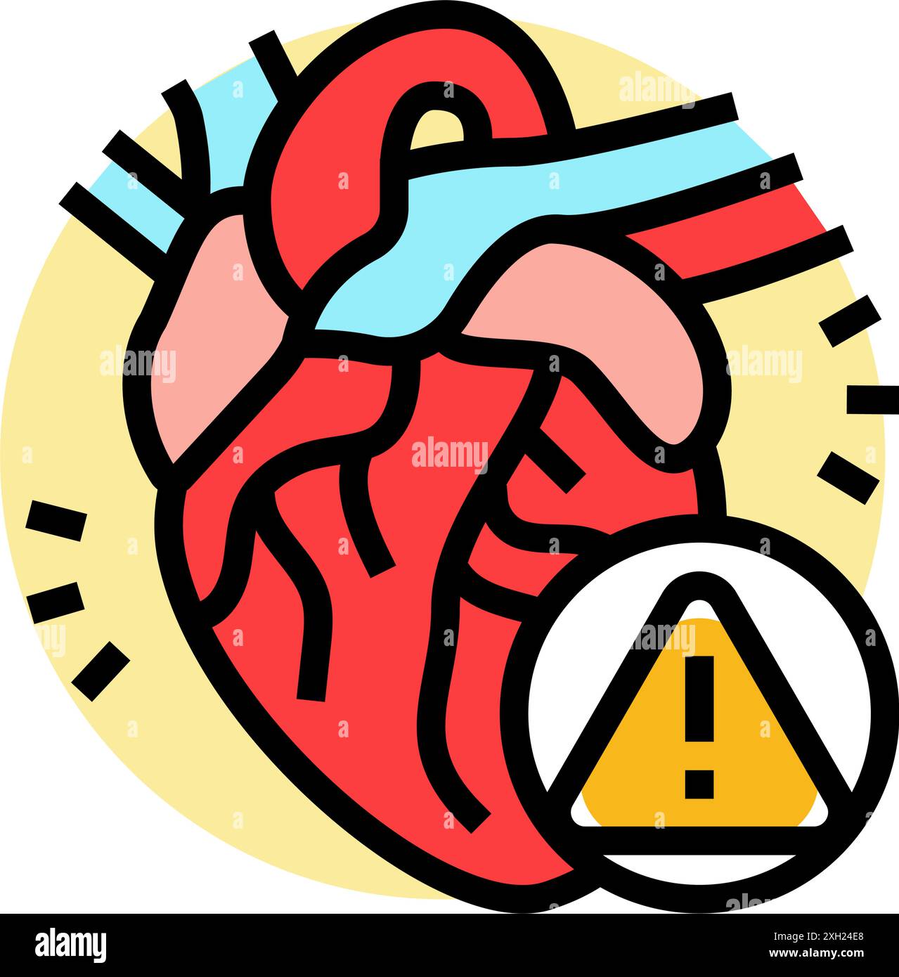 cardiovascular disease obesity overweight color icon vector ...