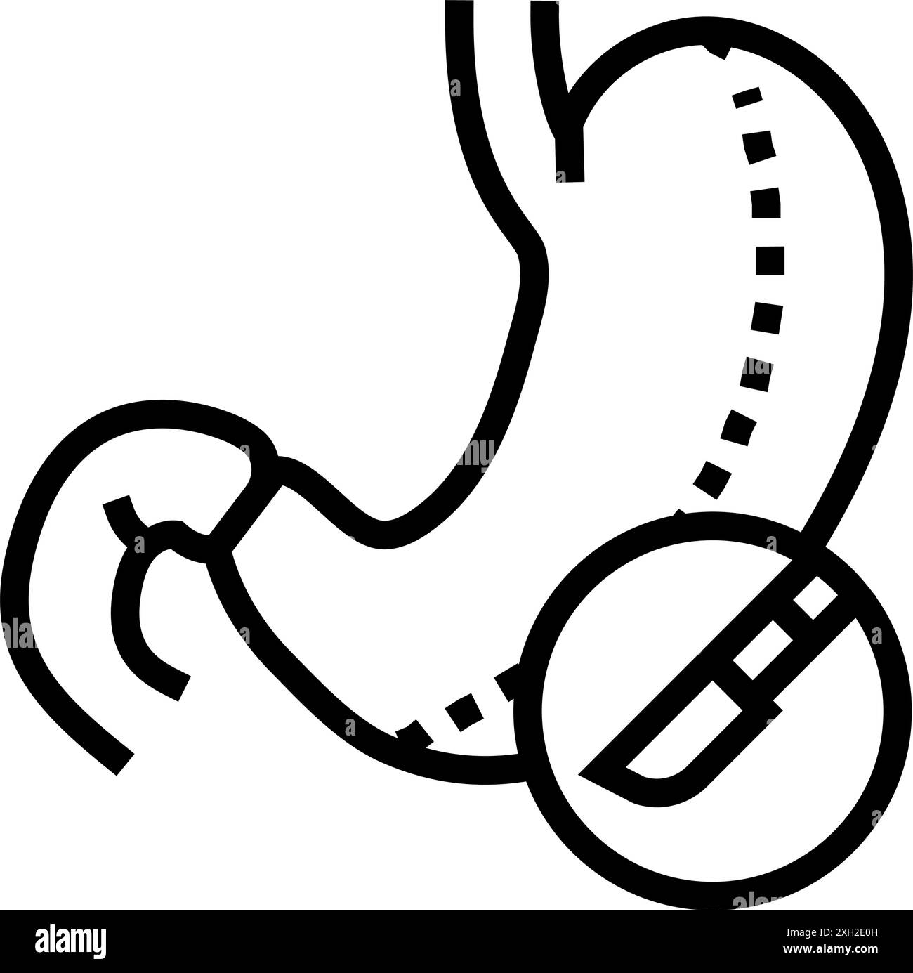 bariatric surgery obesity overweight line icon vector illustration ...