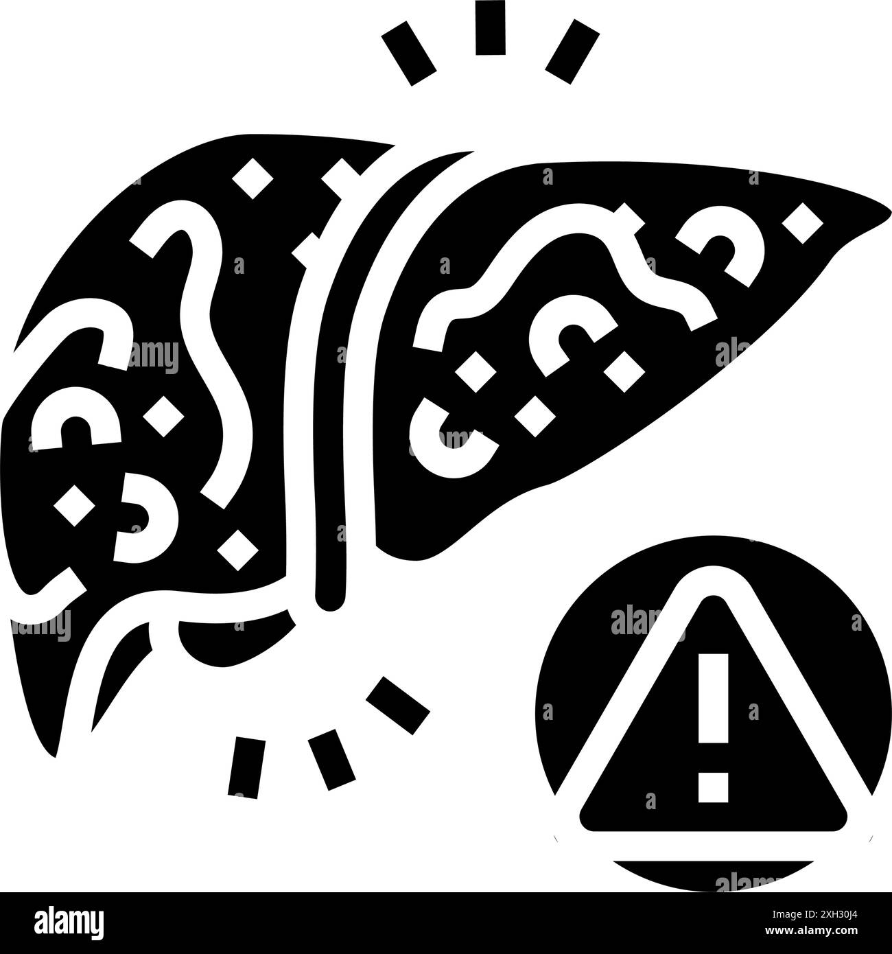 fatty liver disease obesity overweight glyph icon vector illustration ...