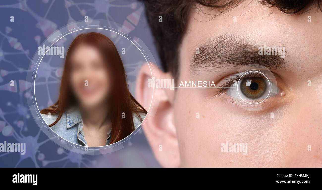 Suffering from amnesia, banner design. Man struggling to remember girl ...