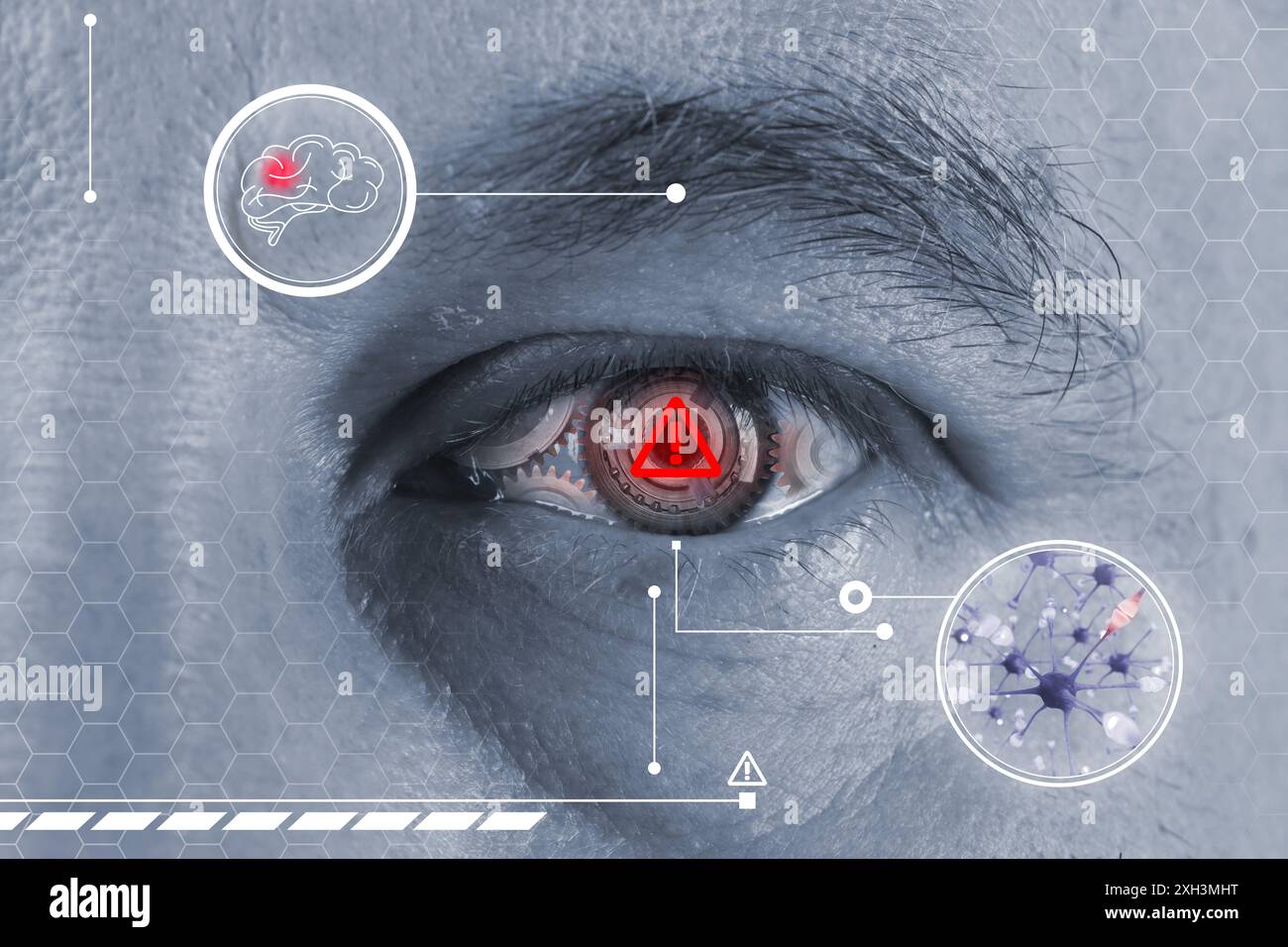 Amnesia. Man's eye with warning sign and cogwheels, closeup ...