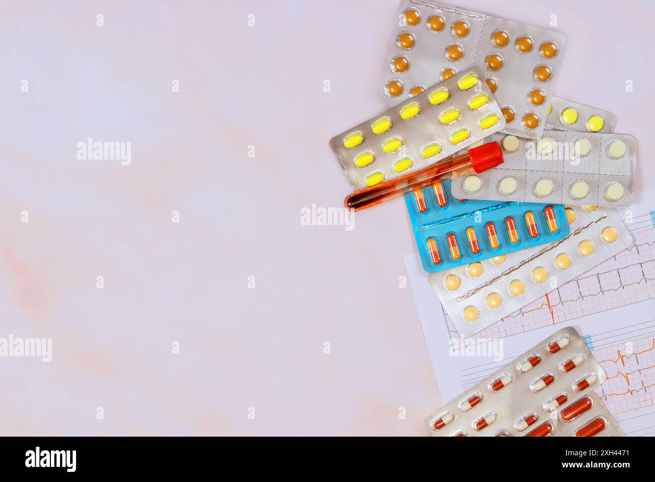 After examining electrocardiogram, cardiologist prescribe necessary ...