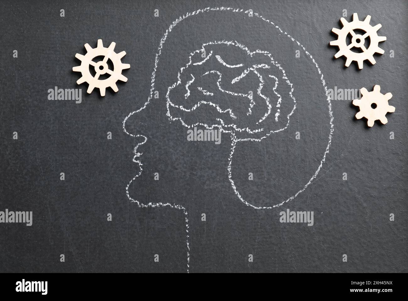 Amnesia problem. Drawing of head, brain and gears on black background ...