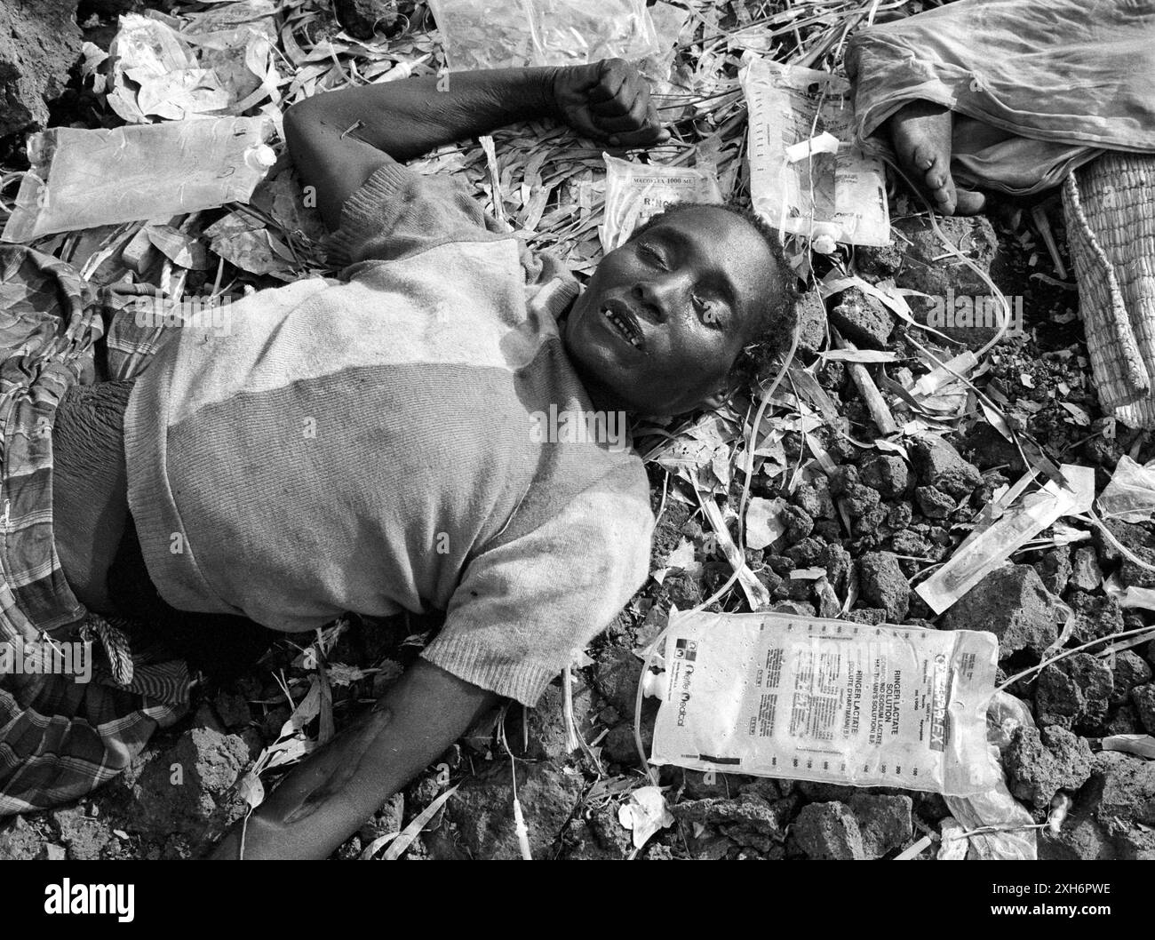 ZAIRE : This woman is a victim of the cholera epidemic near Goma, July ...
