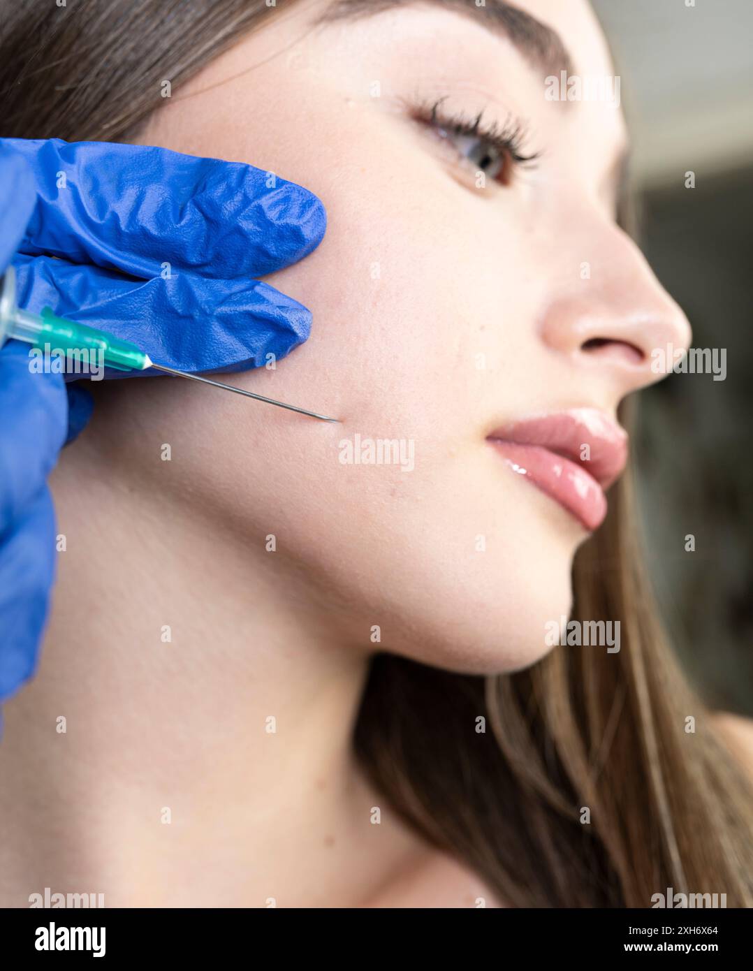 Woman getting cosmetic injection of botox in cheek, closeup. Woman in ...
