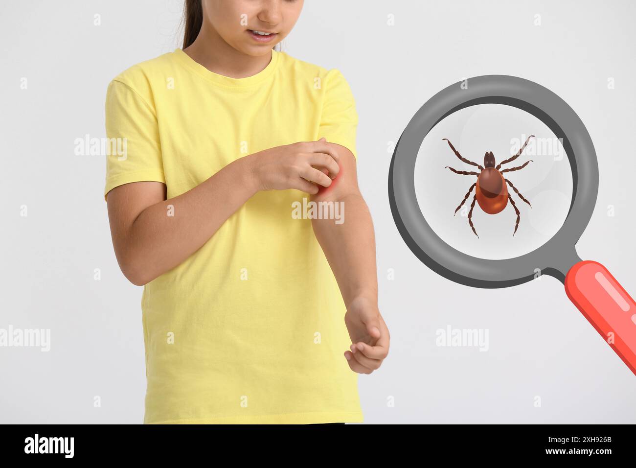 Little girl scratching her skin and tick visible through magnifying ...