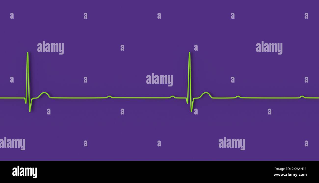 Illustration of an electrocardiogram (ECG) depicting a complete heart ...