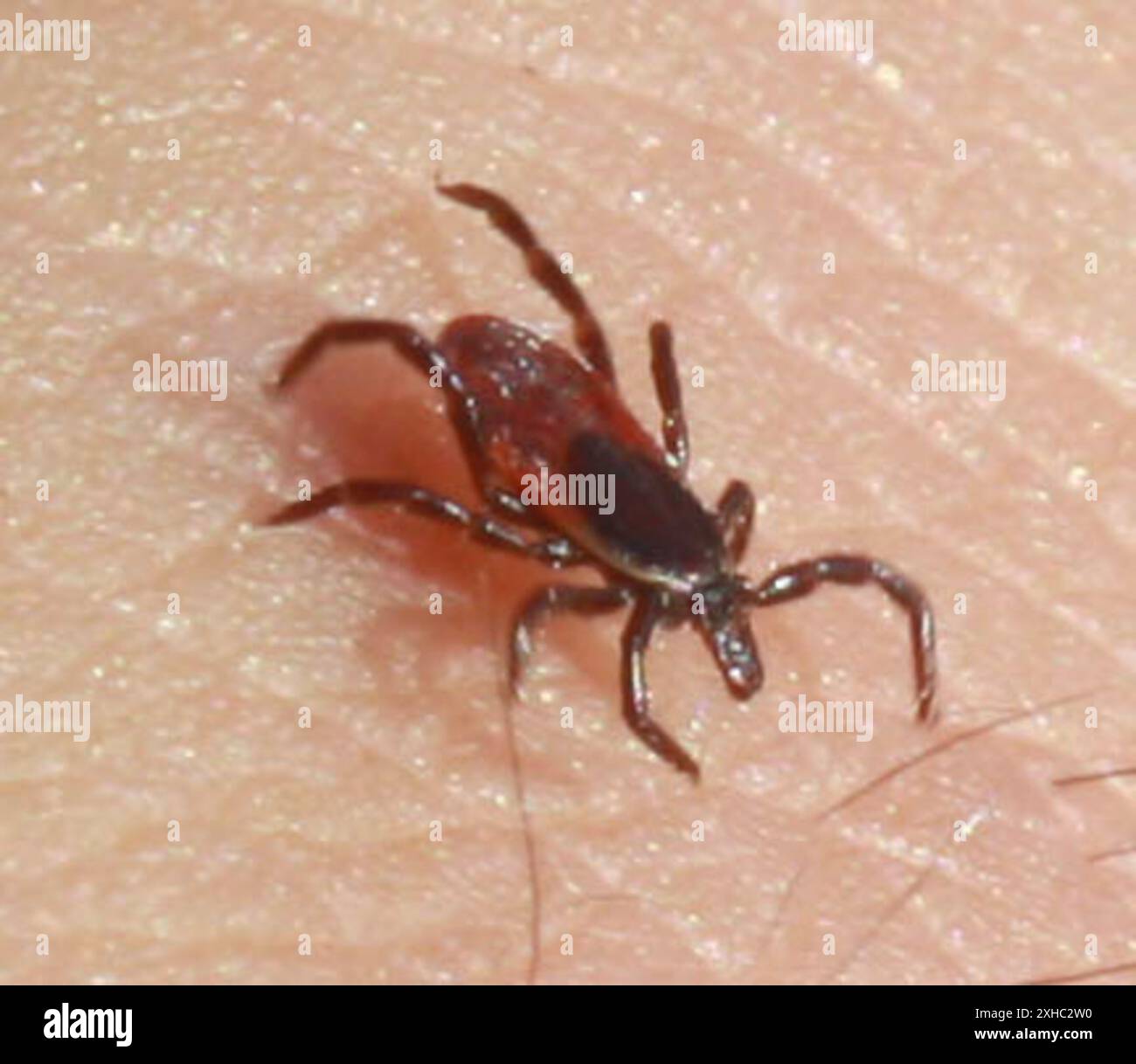 Western Black-legged Tick (Ixodes pacificus) tenessee valley marin ...