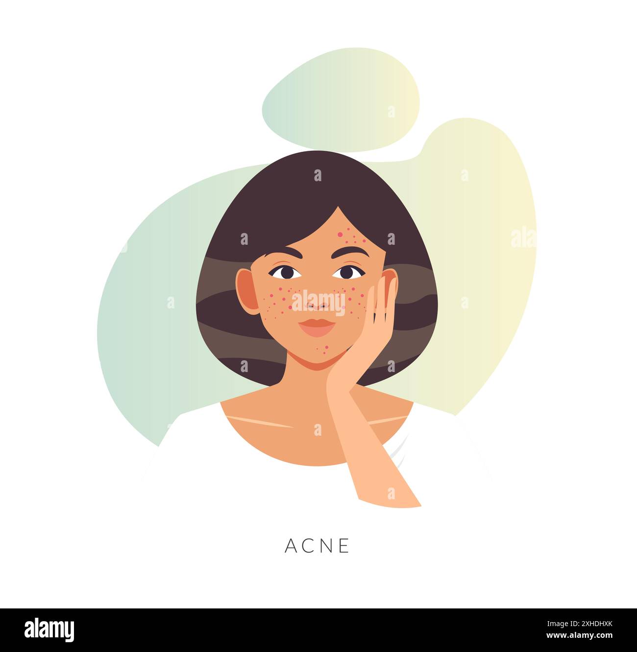 Understanding Skin Acne - Stock Illustration as EPS 10 File Stock ...