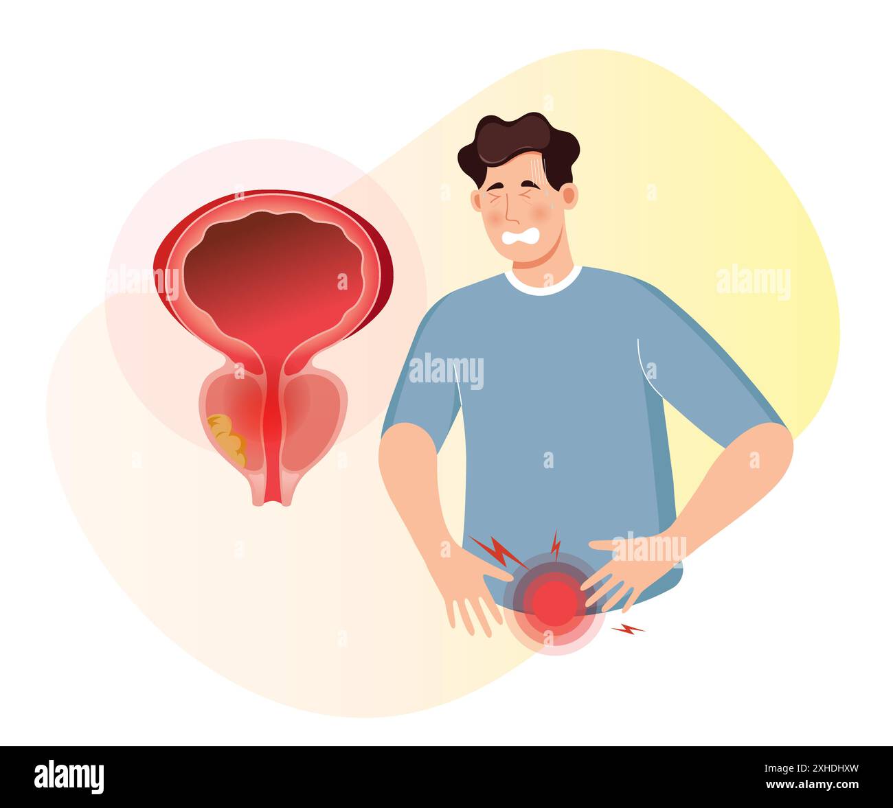 Urethra hi-res stock photography and images - Alamy