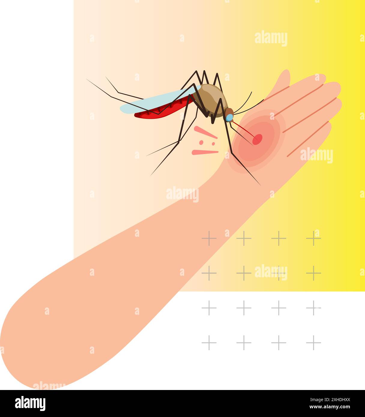 Mosquito biting on Human Skin - Stock Illustration as EPS 10 File Stock ...