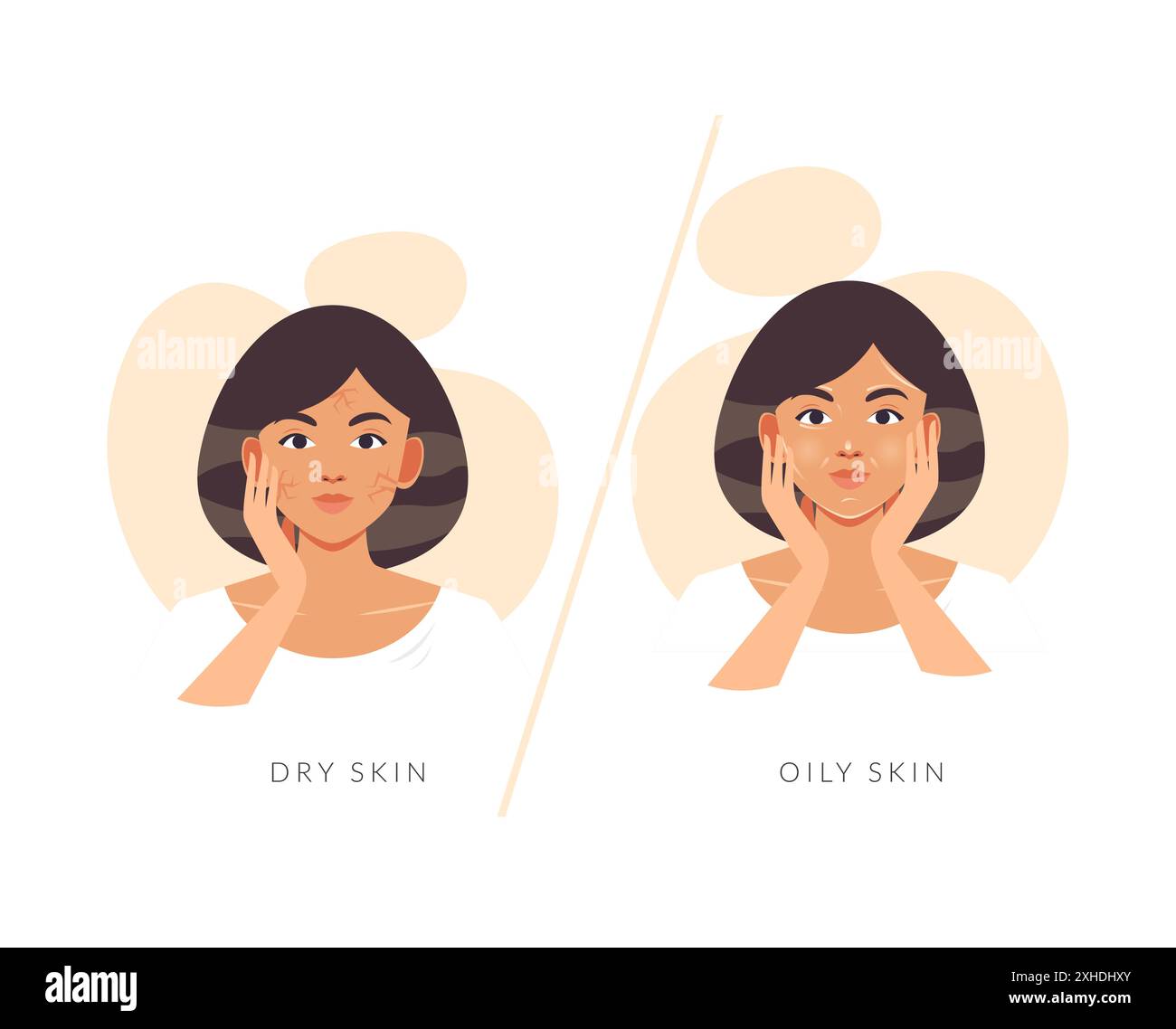 Understanding Dry Skin Vs Oily Skin - Stock Illustration as EPS 10 File Stock Vector Image & Art ...