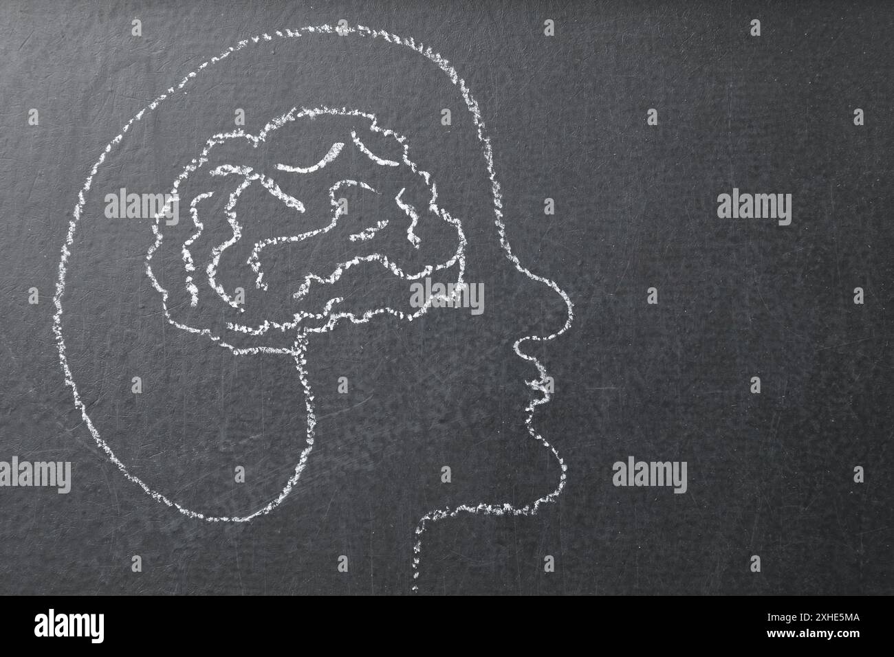 Amnesia problem. Drawing of head and brain on black background, top ...