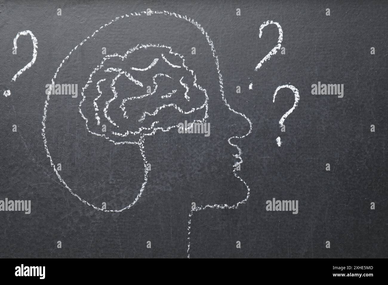 Amnesia problem. Drawing of head, brain and question marks on black ...