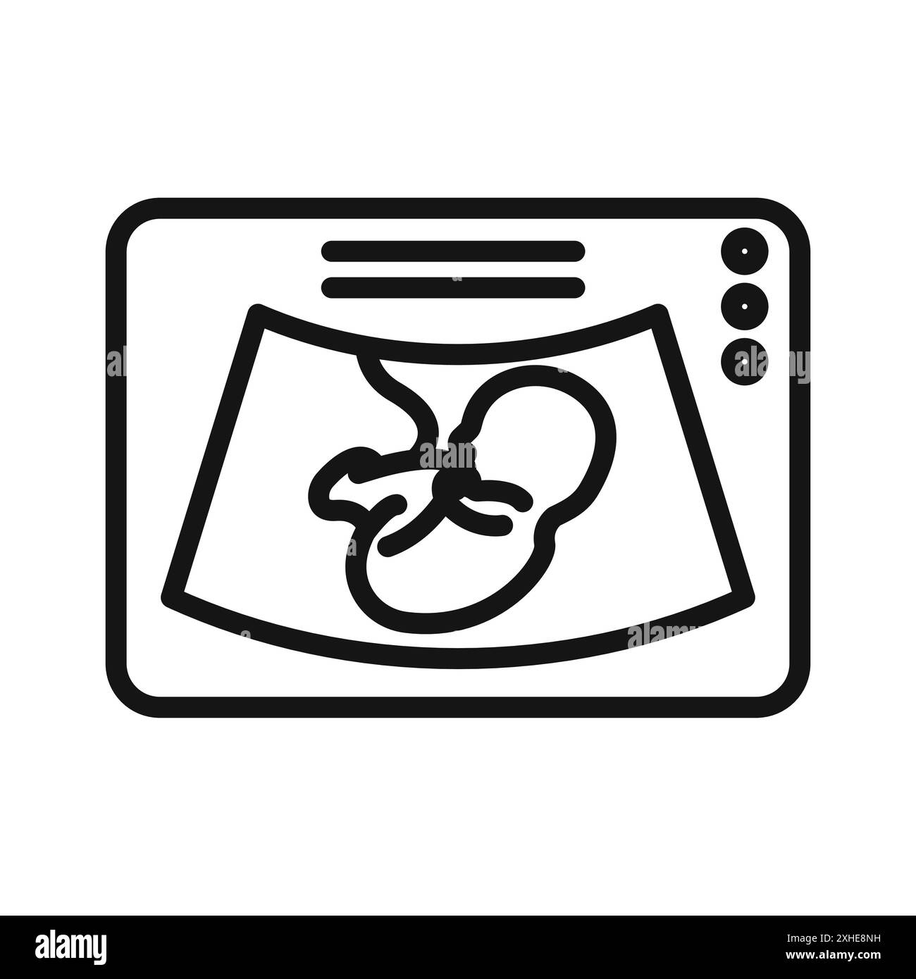 Ultrasonography icon Vector symbol or sign set collection in black and ...