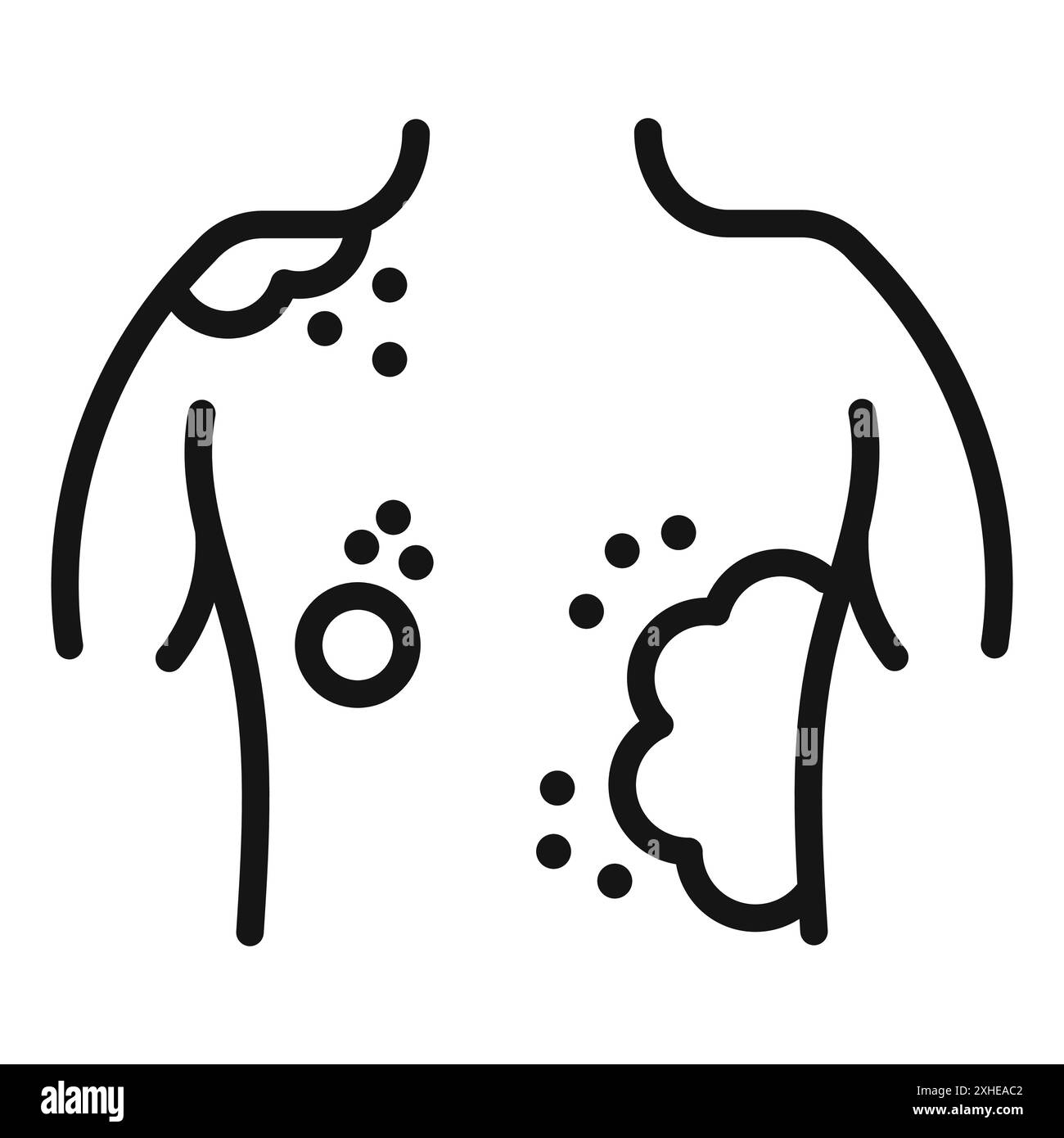 Skin cancer icon Vector symbol or sign set collection in black and ...