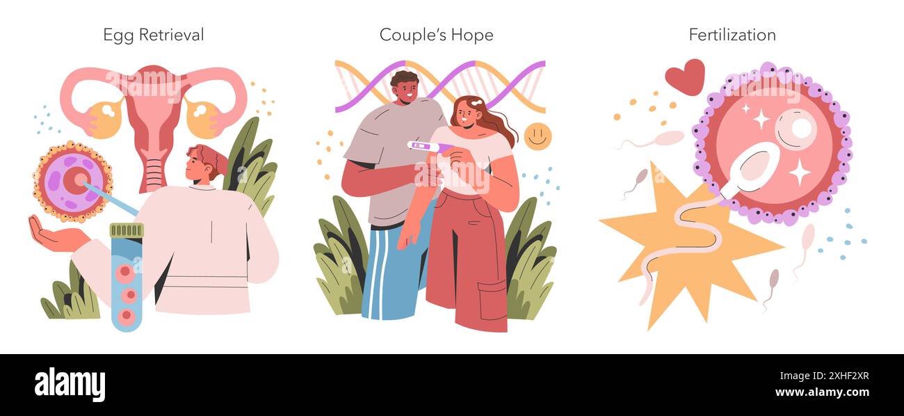 Assisted Reproduction set. Illustrating egg retrieval, hopeful couple ...