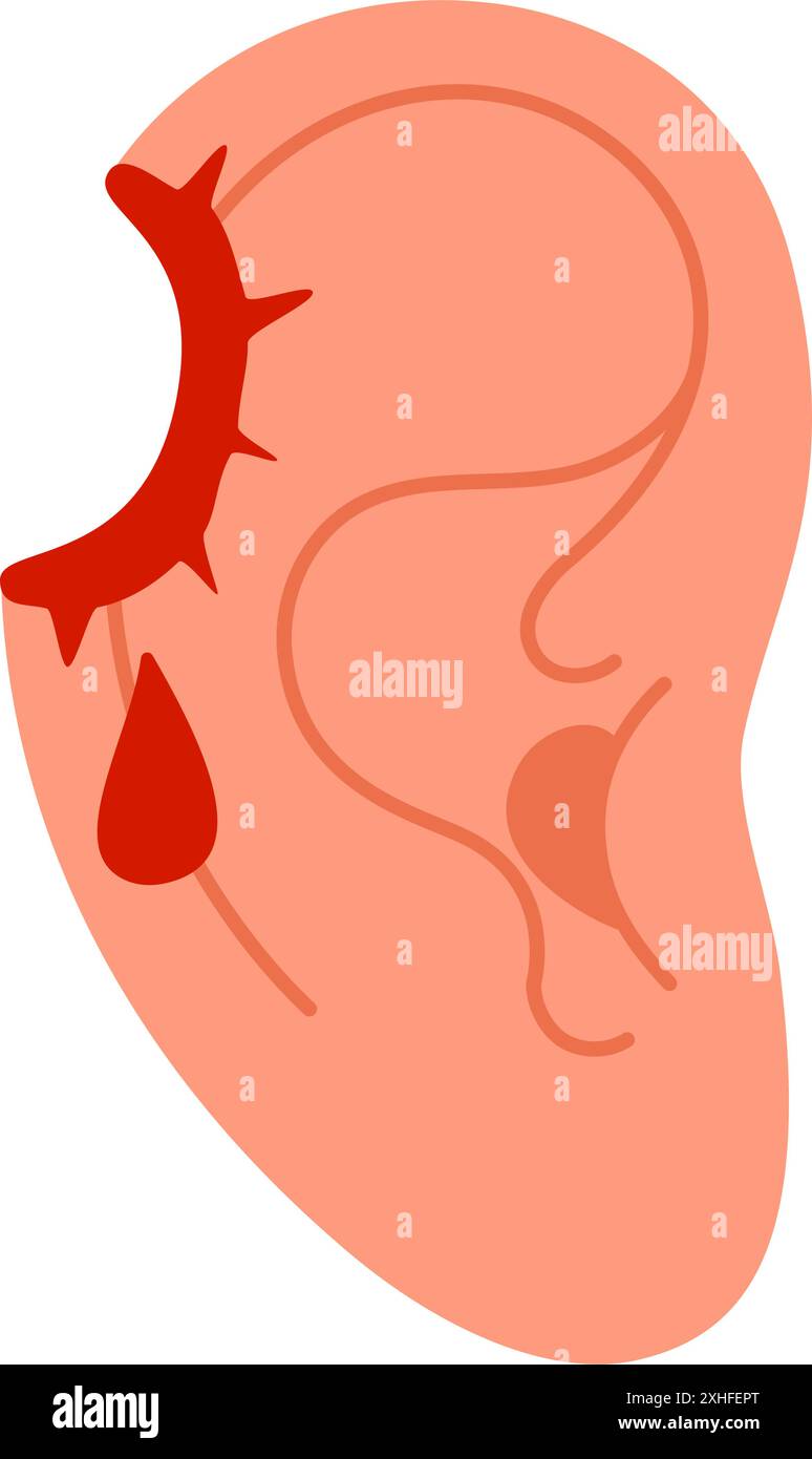 Bleeding From Ears Images Clipart