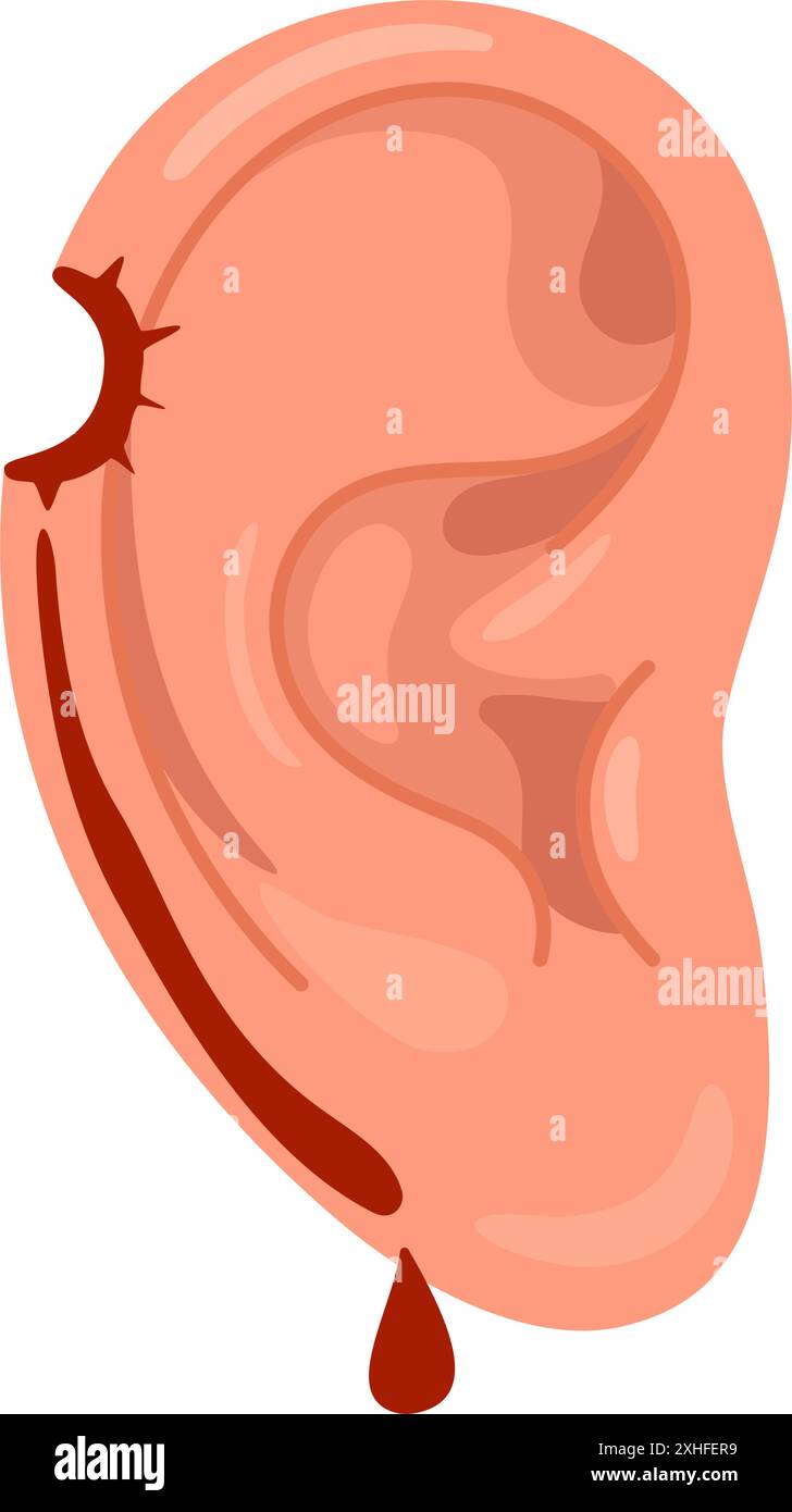 Wounded ear. bullet hole. Injured human ear with blood drops. a sense ...