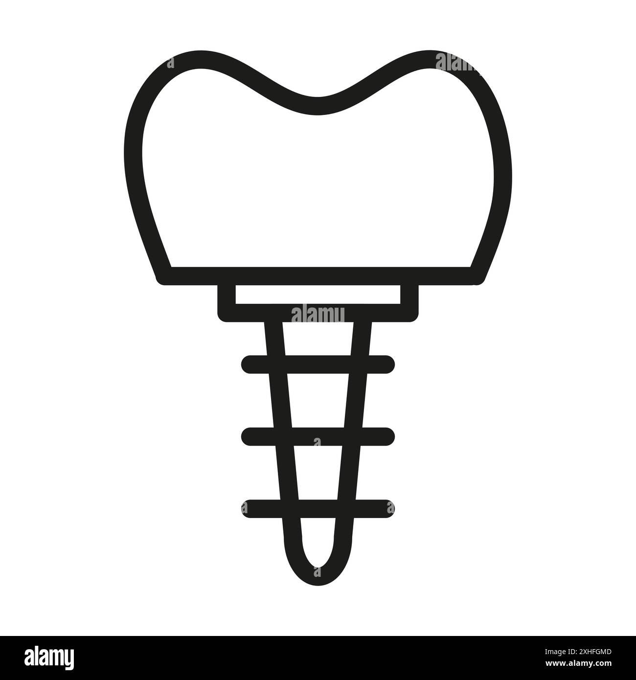 Dental implants icon Vector symbol or sign set collection in black and ...
