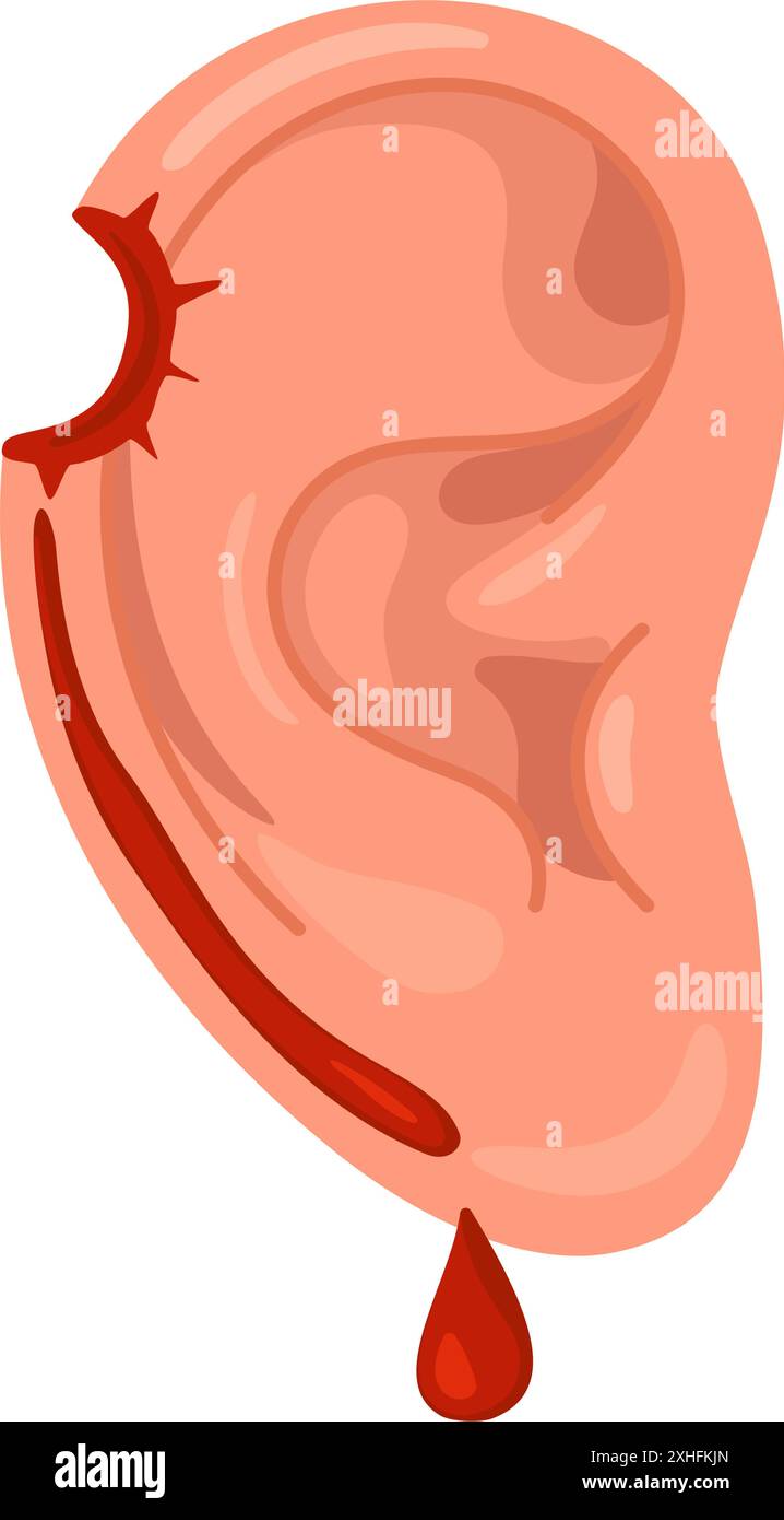 Wounded ear. bullet hole. Injured human ear with blood drops. a sense ...