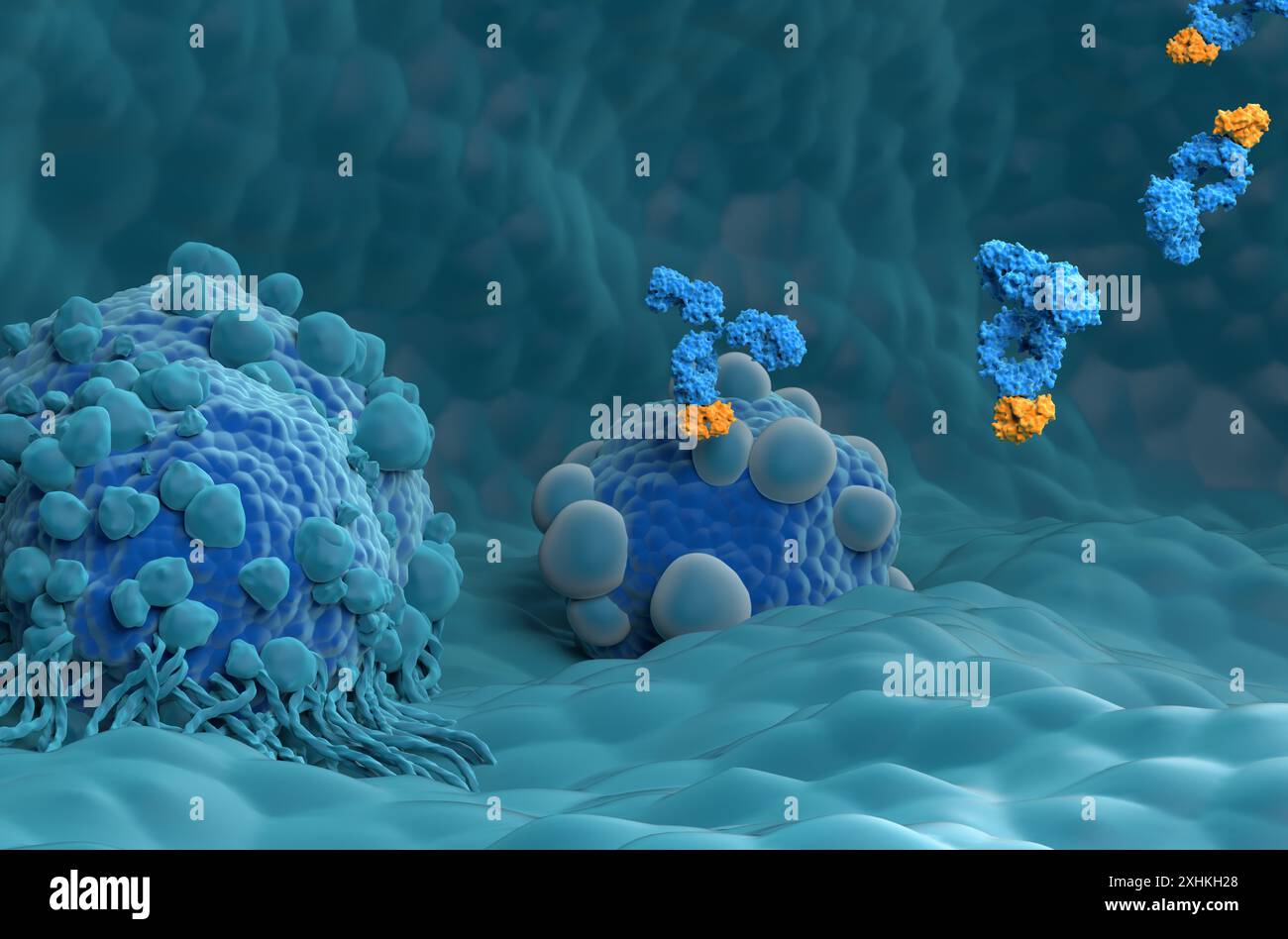 Monoclonal antibody treatment in Pancreatic cancer - closeup view 3d ...