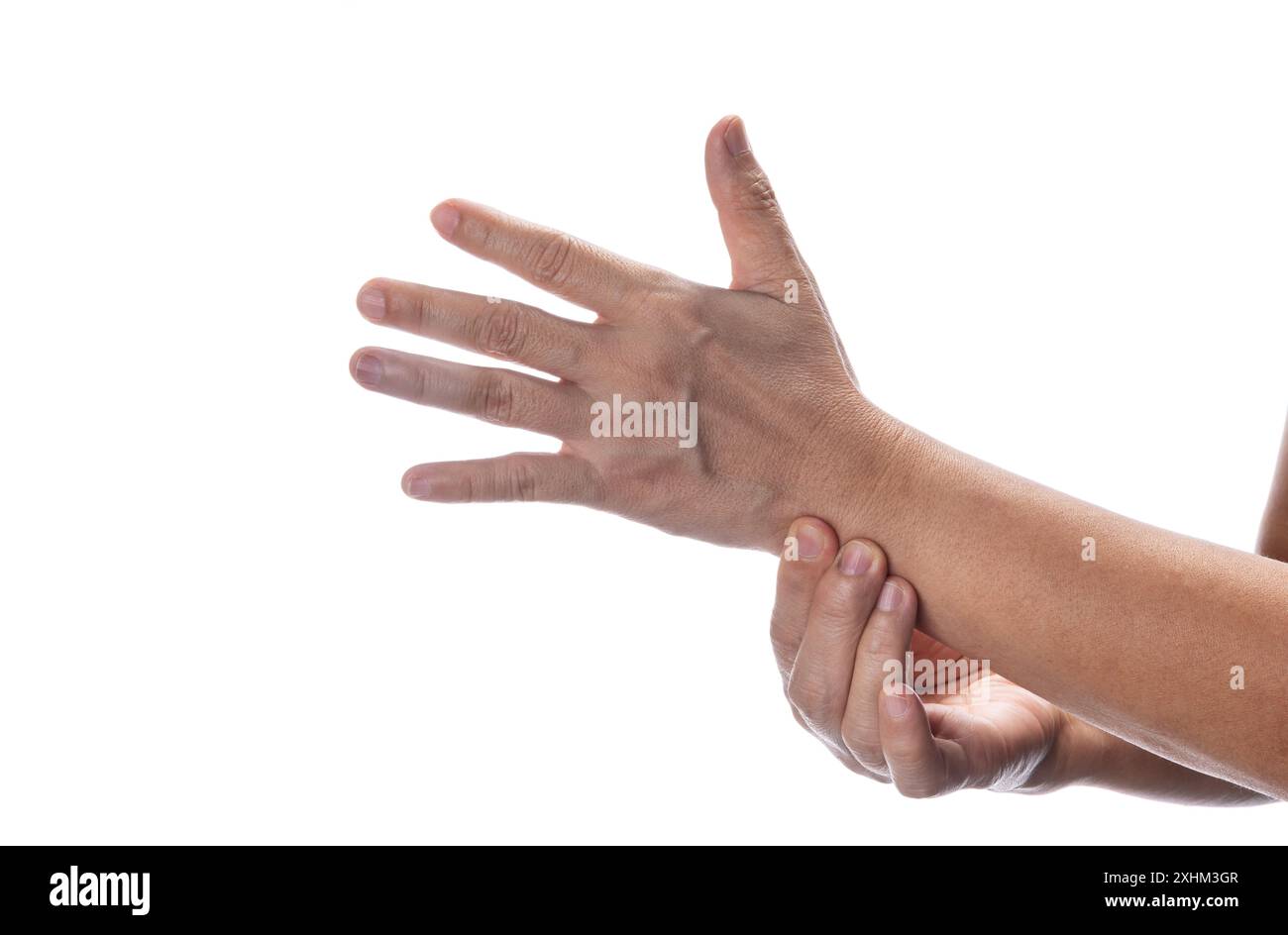 Numbness and tingling is a symptom of Ulnar tunnel syndrome, also known ...