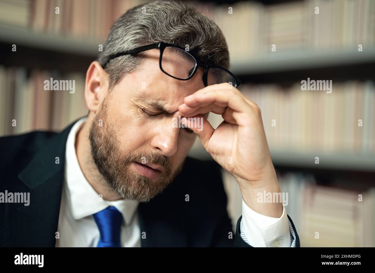 Close up face of stressed man with headache migraine. Cephalalgia and ...