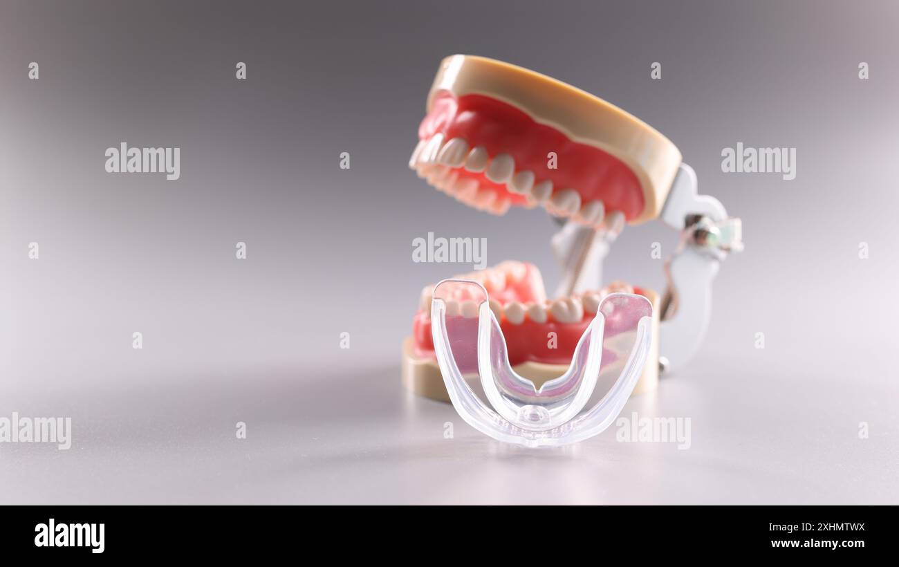 Close-up of tooth model and aligner teeth orthodontic dental model or ...