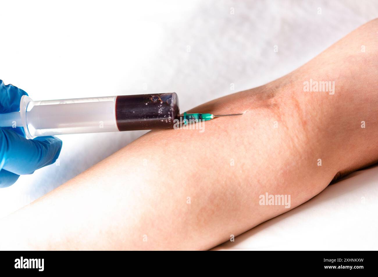 Nurse's hands with a gloved syringe. Blood sampling for analysis Stock ...