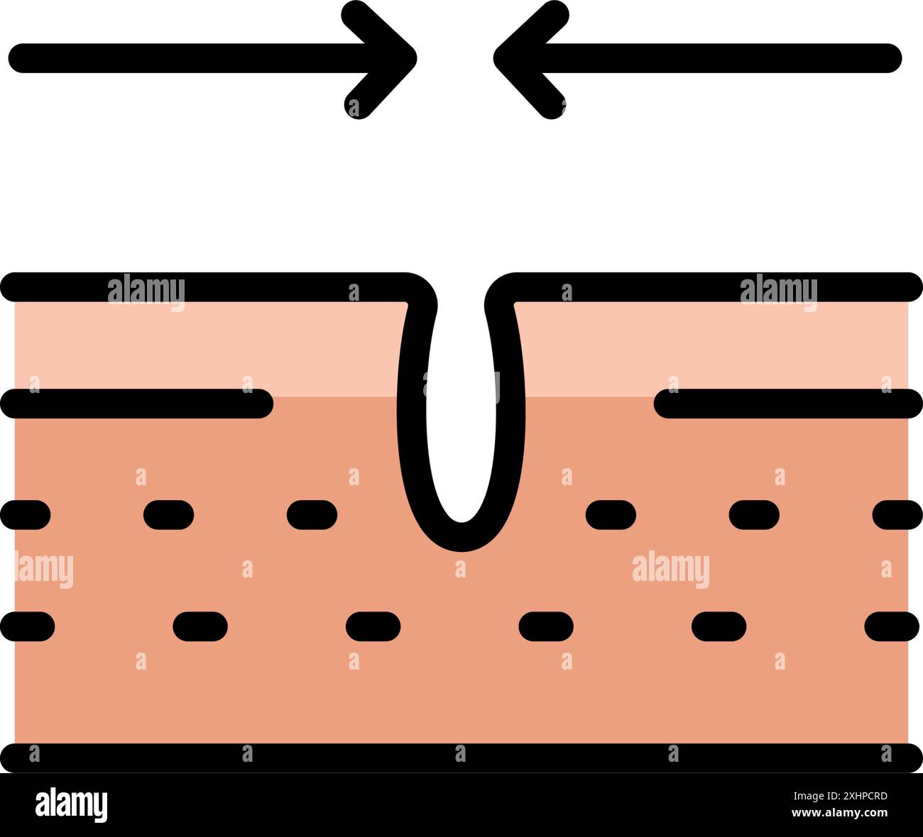 Pore narrowing Stock Vector Images - Alamy