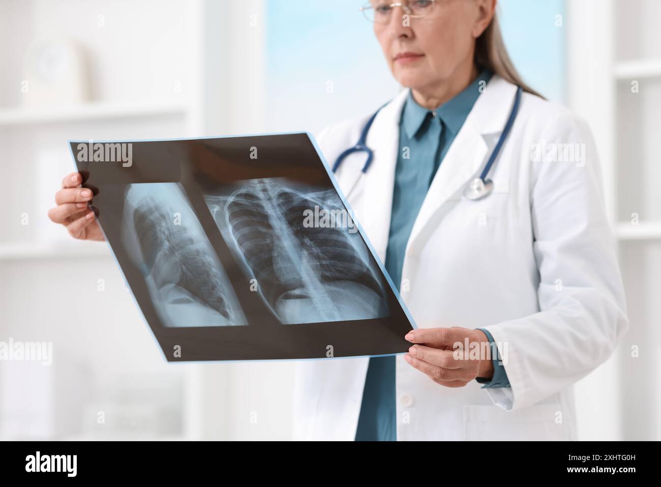 Lung disease. Doctor examining chest x-ray in clinic Stock Photo - Alamy