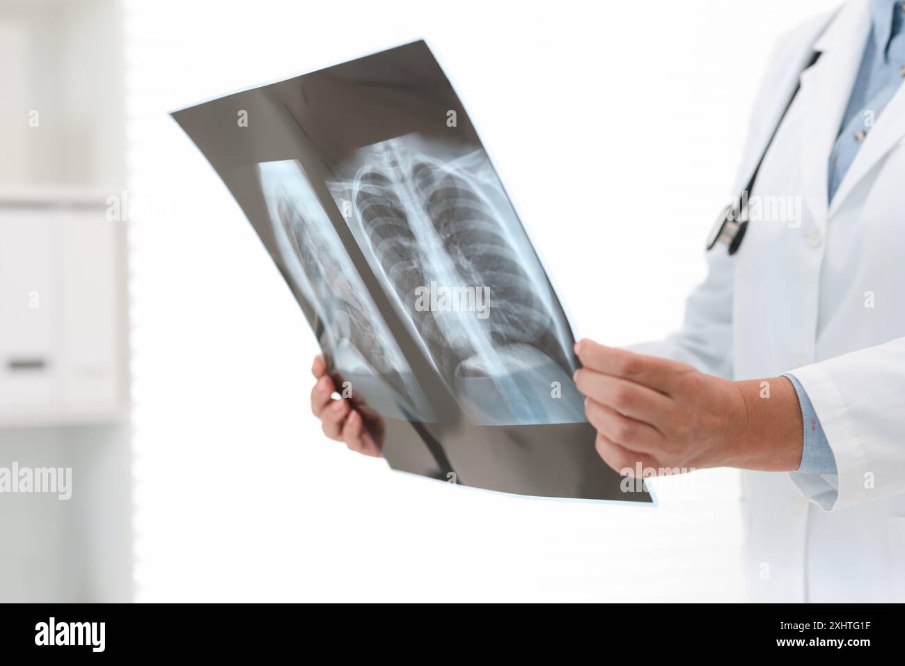 Lung disease. Doctor examining chest x-ray in clinic, closeup Stock ...