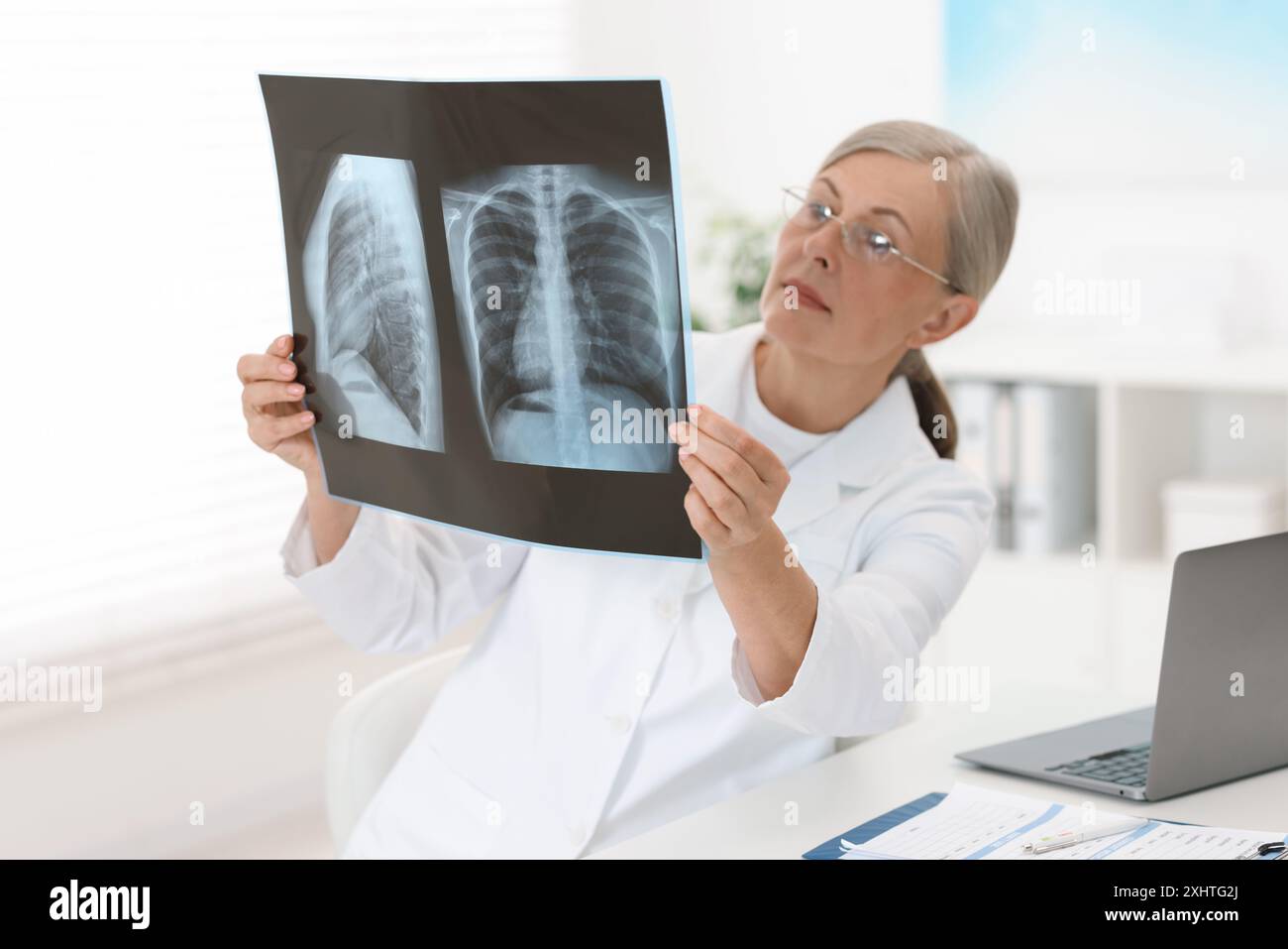 Lung disease. Doctor examining chest x-ray in clinic Stock Photo - Alamy