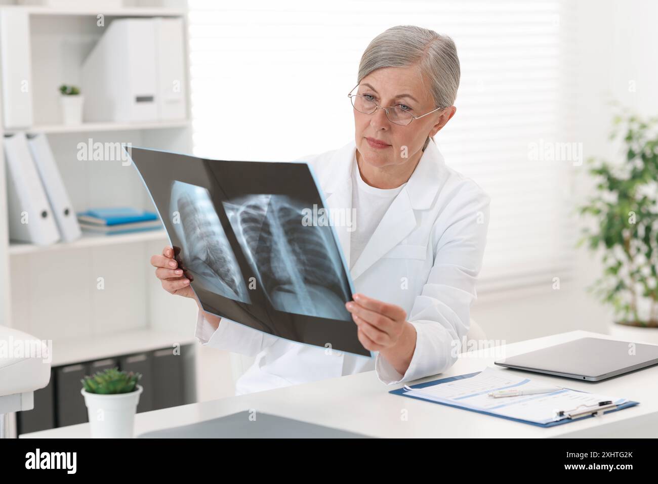 Lung disease. Doctor examining chest x-ray at table in clinic Stock ...