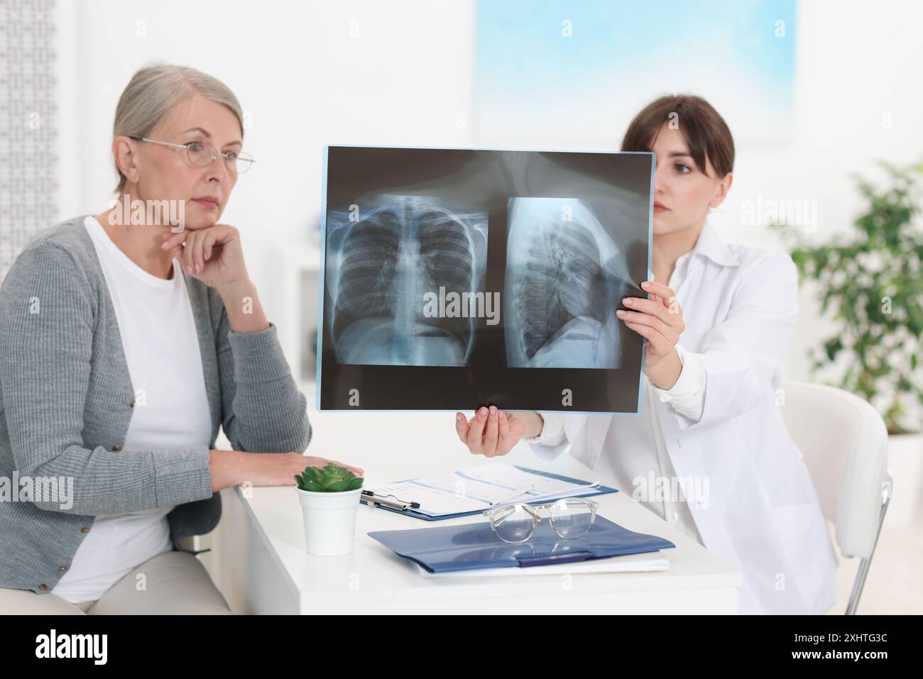 Lung disease. Doctor showing chest x-ray to her patient at table in ...