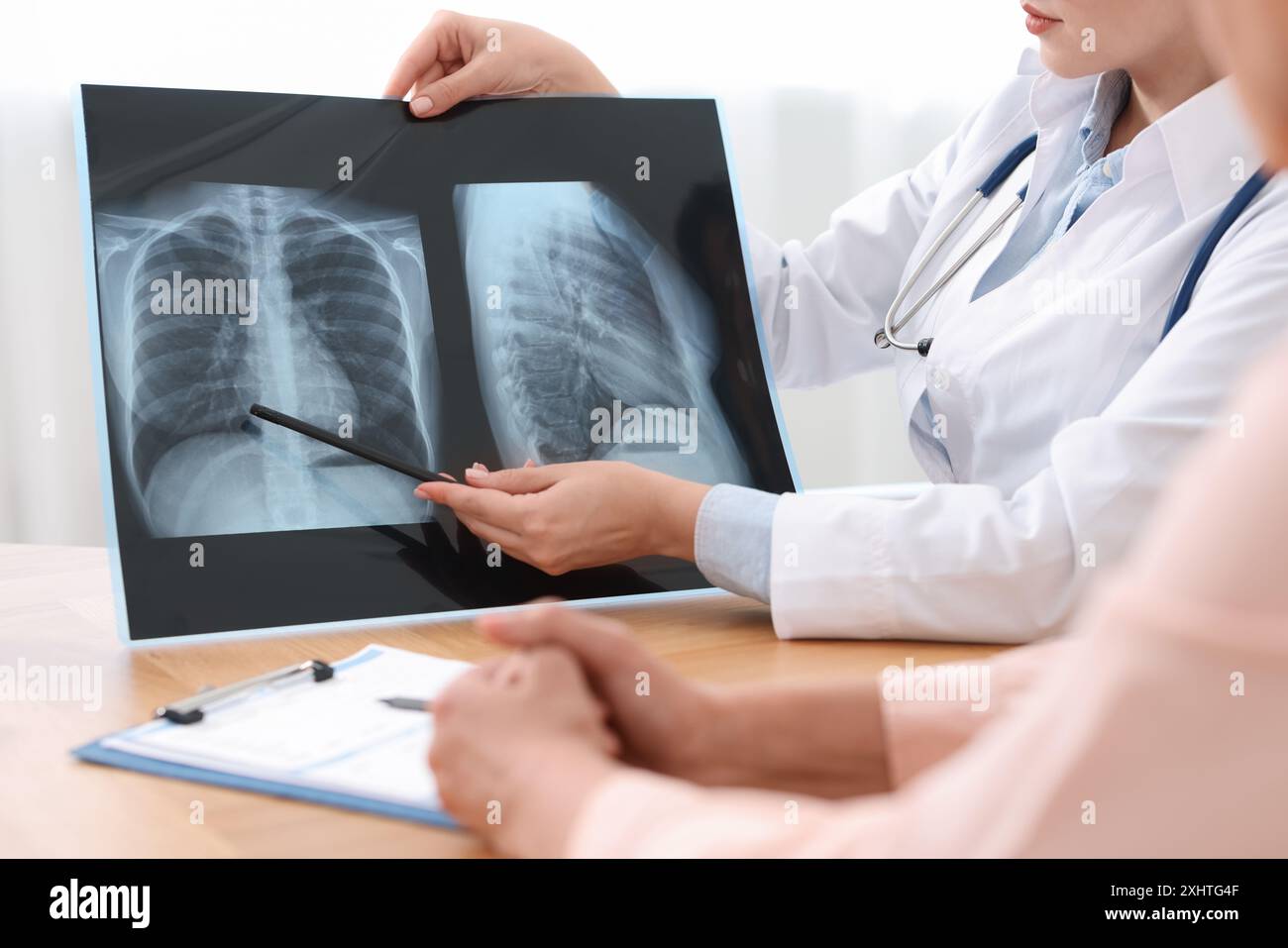 Lung disease. Doctor showing chest x-ray to her patient at table in ...