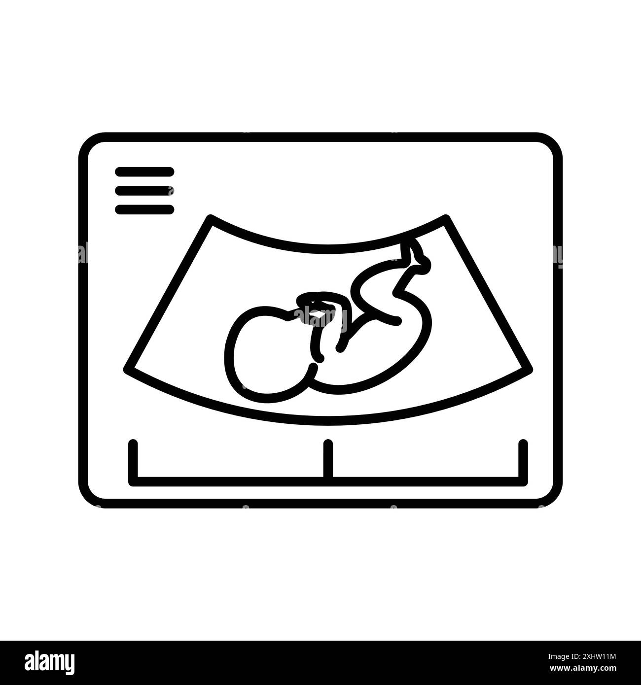 Ultrasonography icon linear logo mark set collection in black and white for web Stock Vector ...