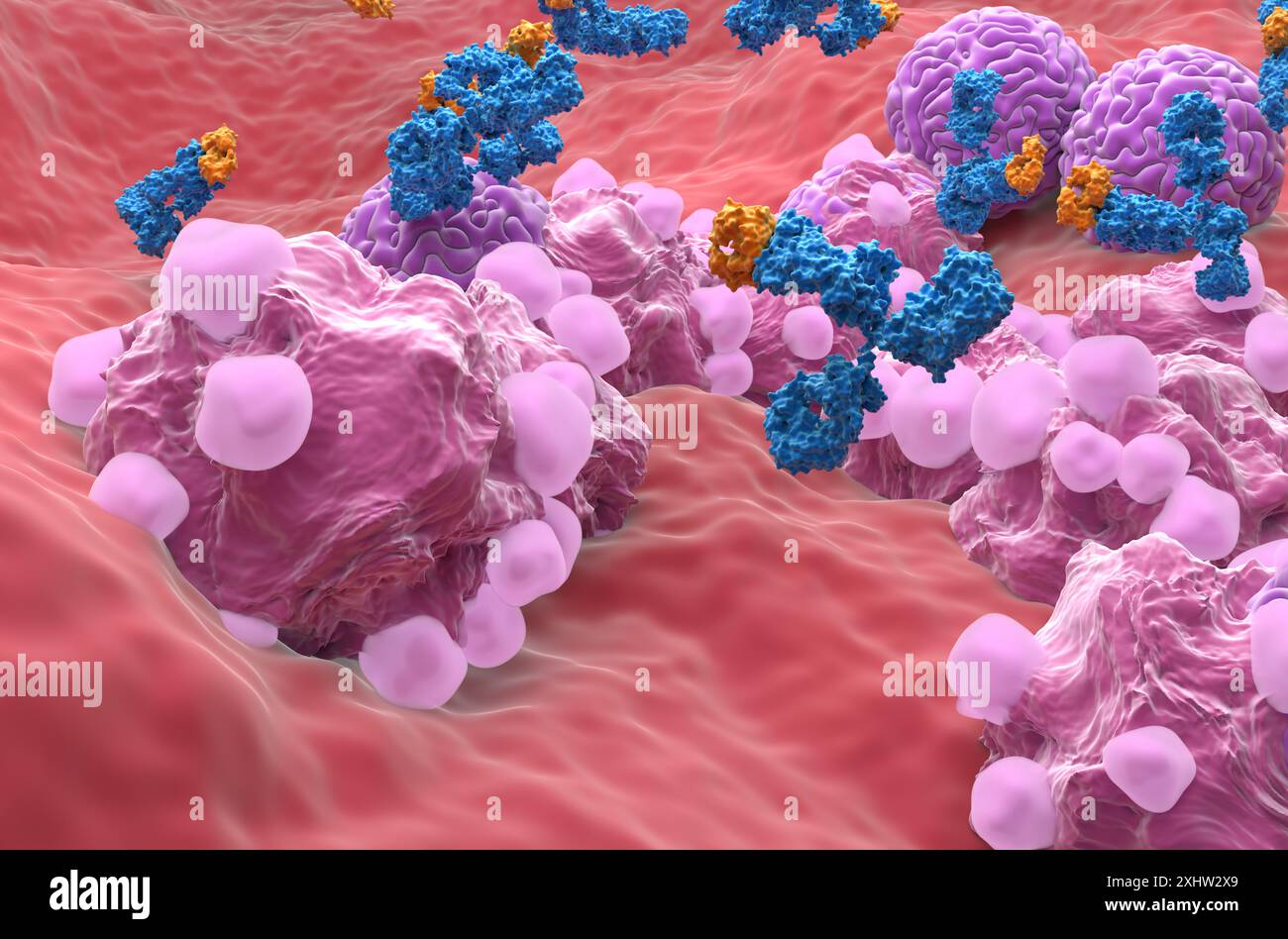 Monoclonal antibody treatment in Ovarian cancer - closeup view 3d ...