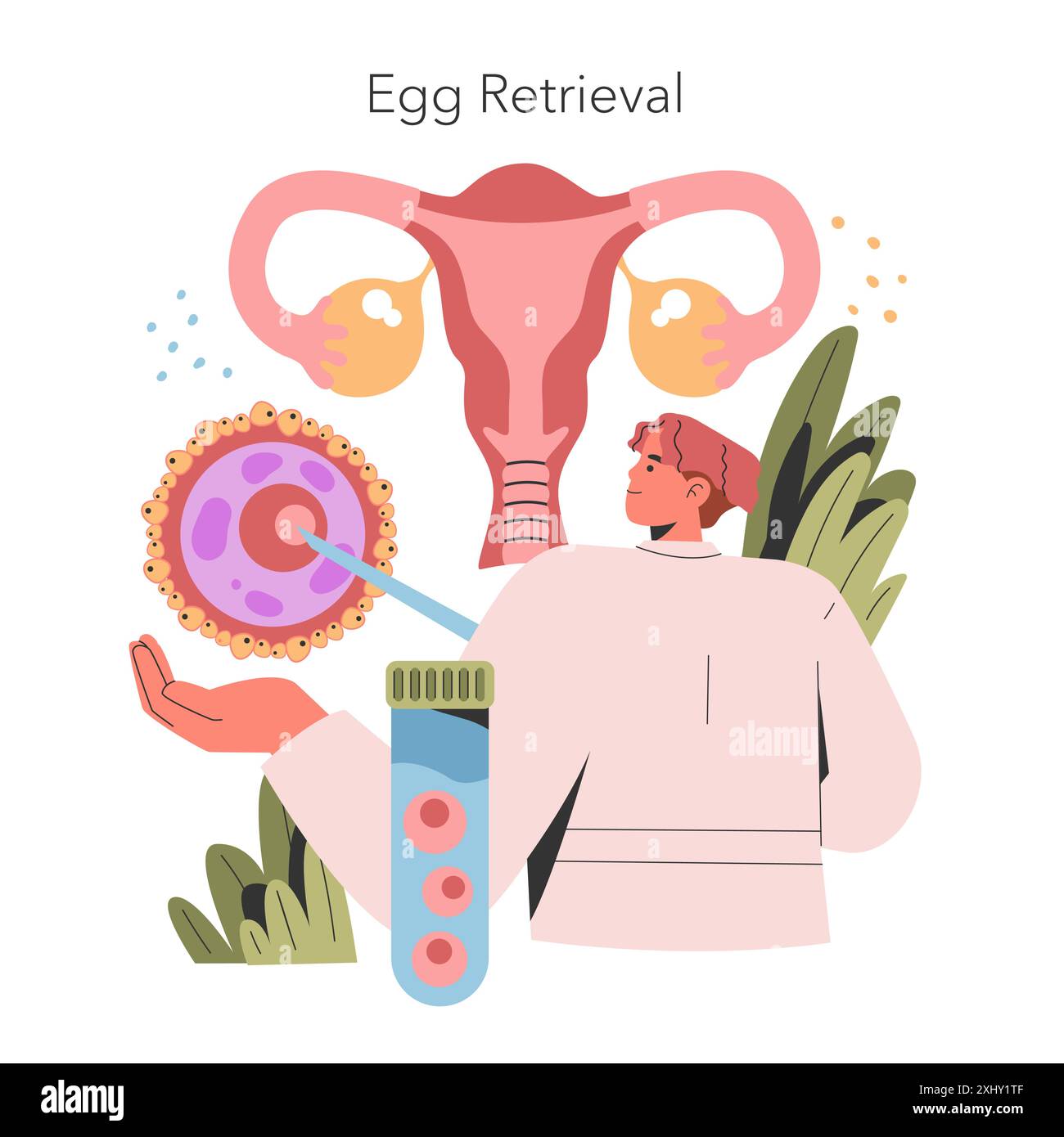 Test Tube Babies concept. Illustration depicting egg retrieval process ...
