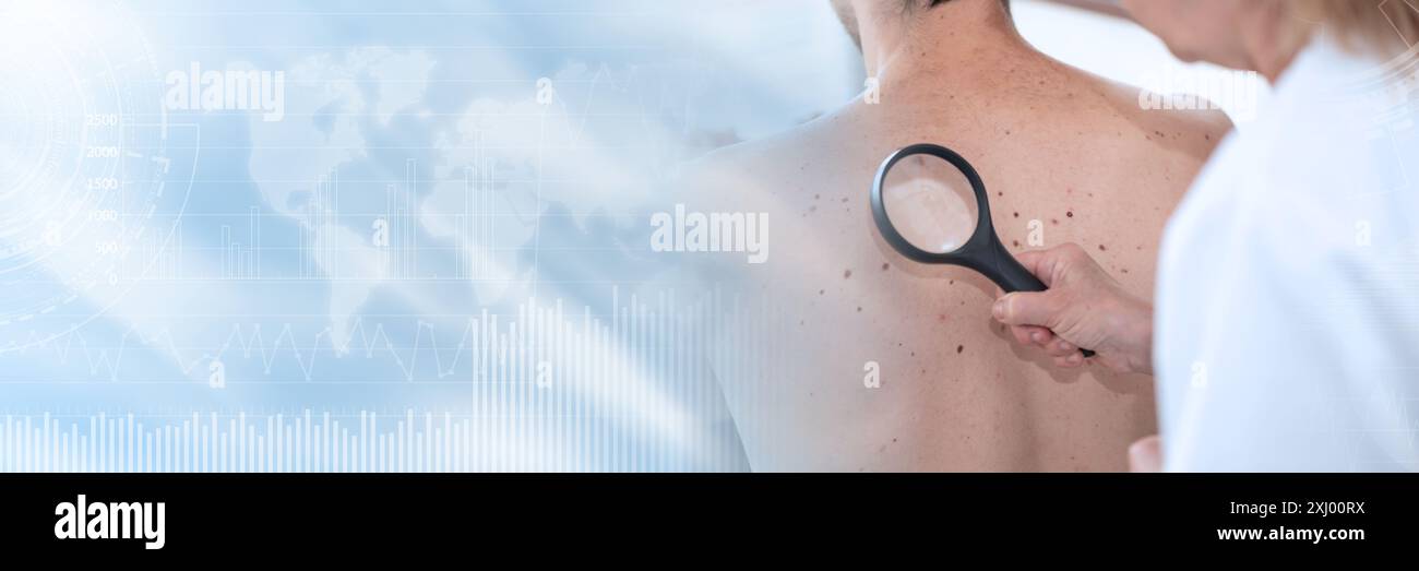 Dermatologist examining the skin of patient back; panoramic banner ...