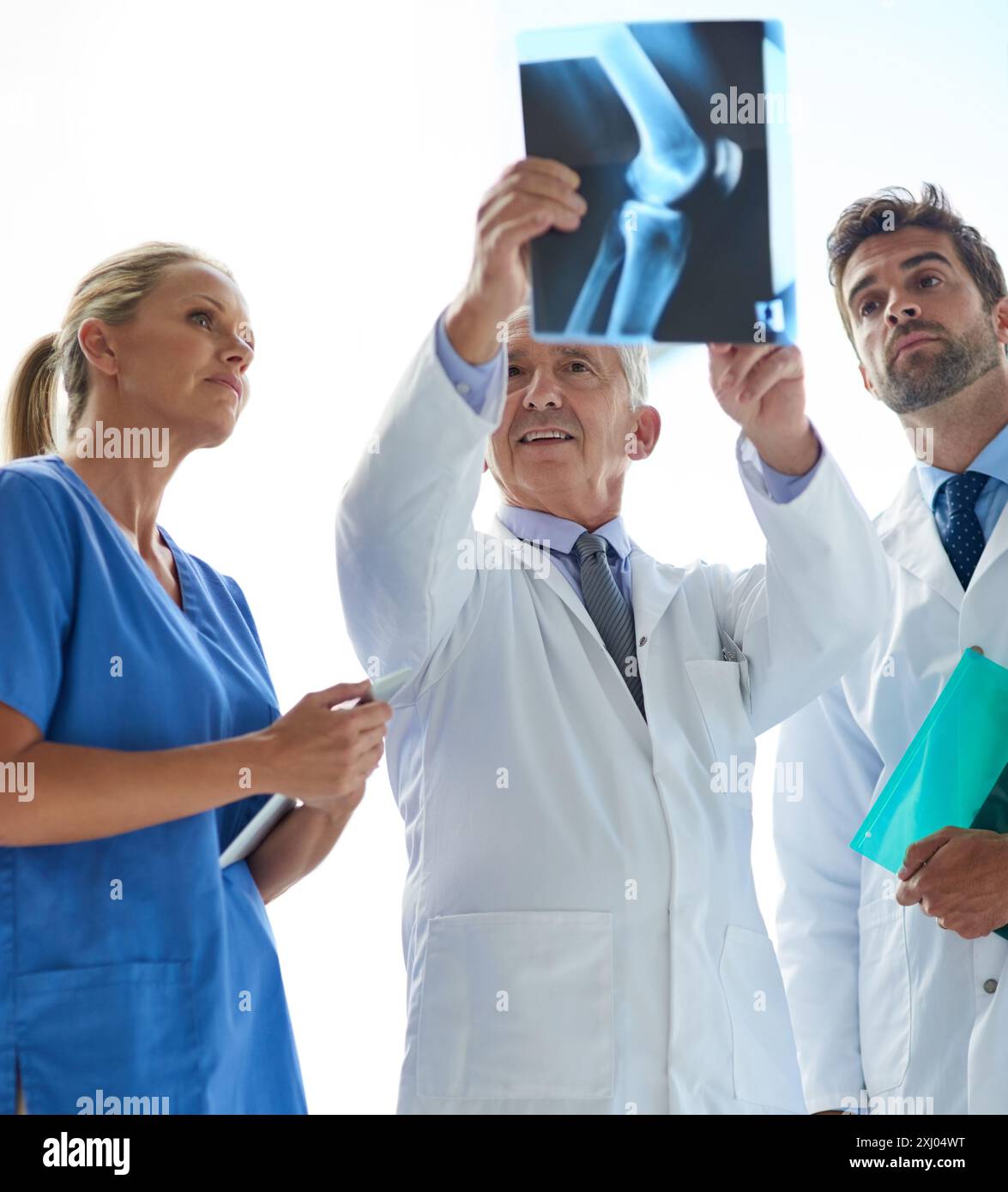 Healthcare, teamwork and medical people with x ray for checking, bone ...