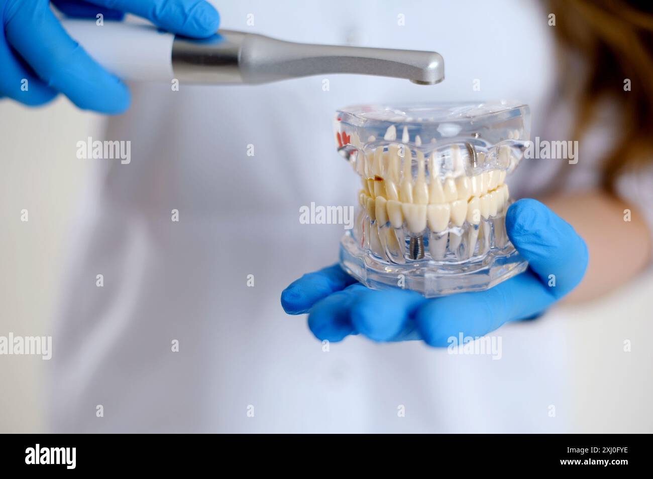 Photopolymer lamp dentist with luminous blue lamp. Dentist treating ...