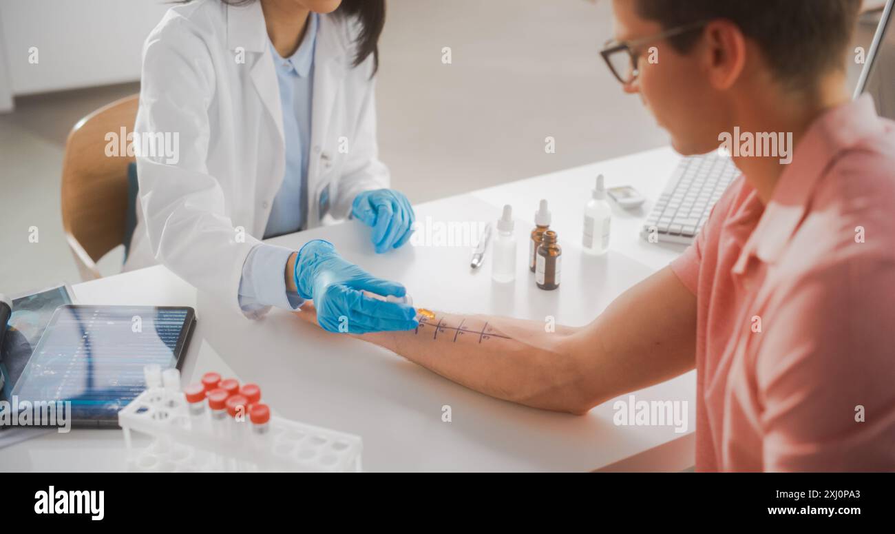 Close Up of a Patient Passing a Prick Scratch Allergy Test. Allergist ...