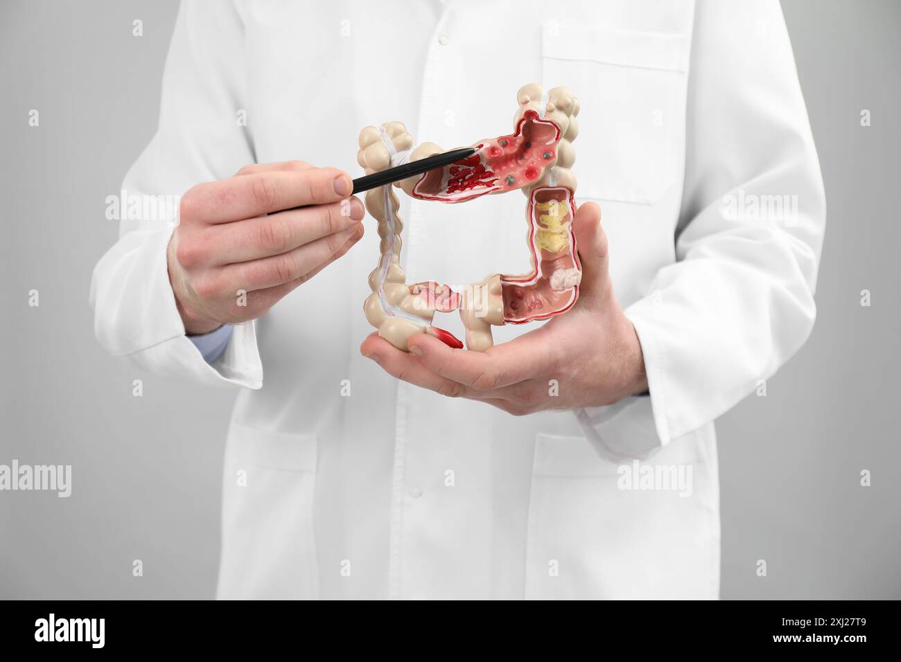 Doctor showing model of large intestine on grey background, closeup ...