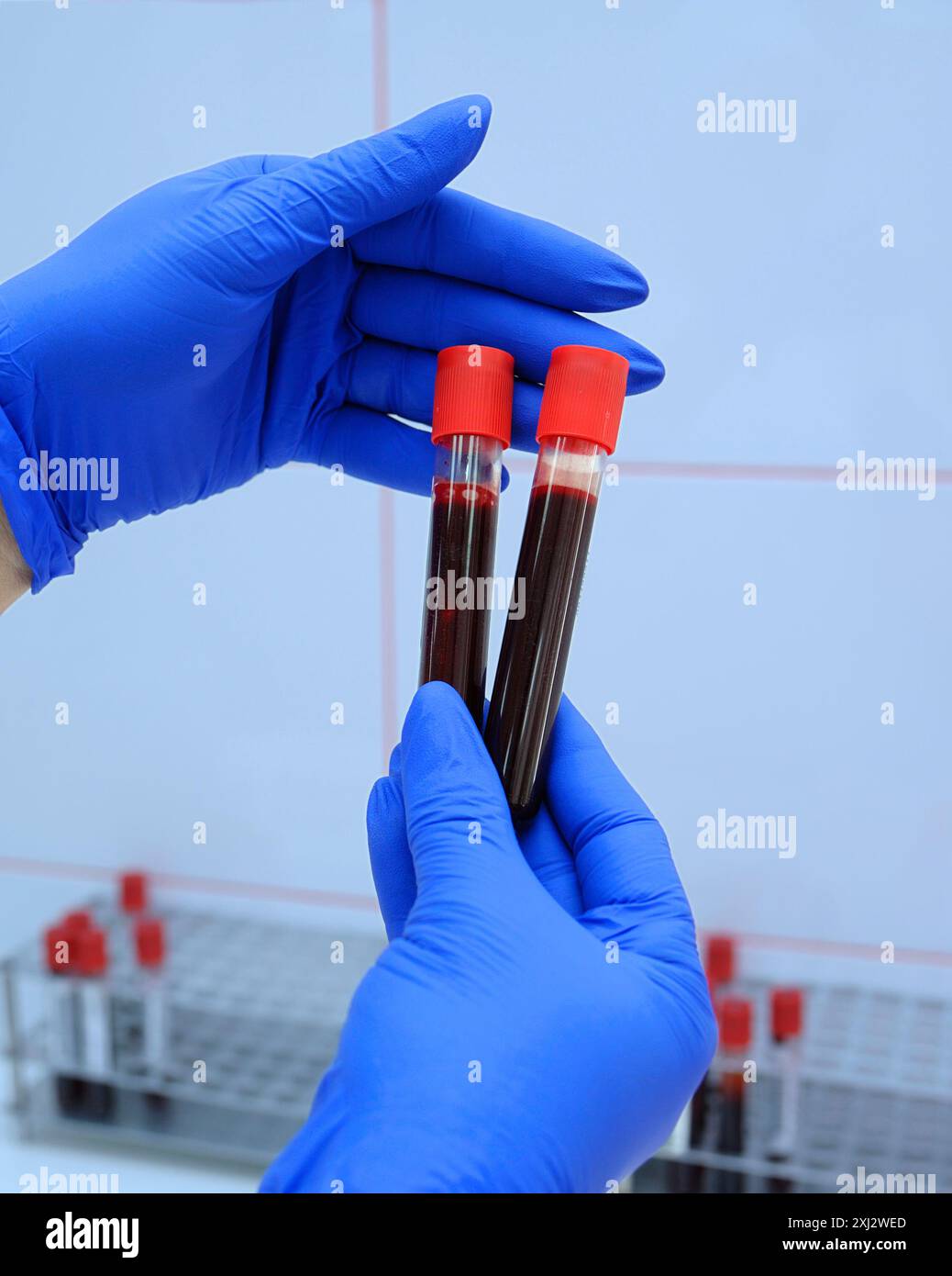Lab assistant hands holding vacutainers with blood samples inside. At ...