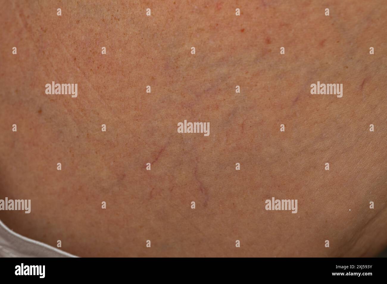 Macro photography of skin, focusing on texture and imperfections to ...