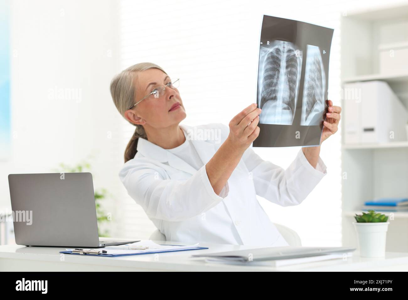 Lung disease. Doctor examining chest x-ray at table in clinic Stock ...